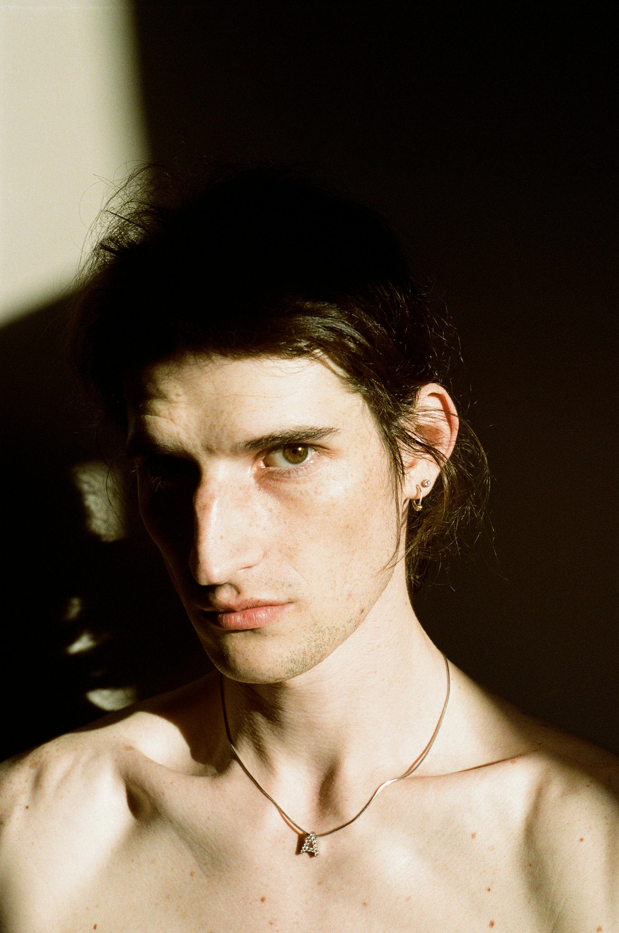 A Headshot of a Male Looking at Camera and Half of His Face Covered in ...