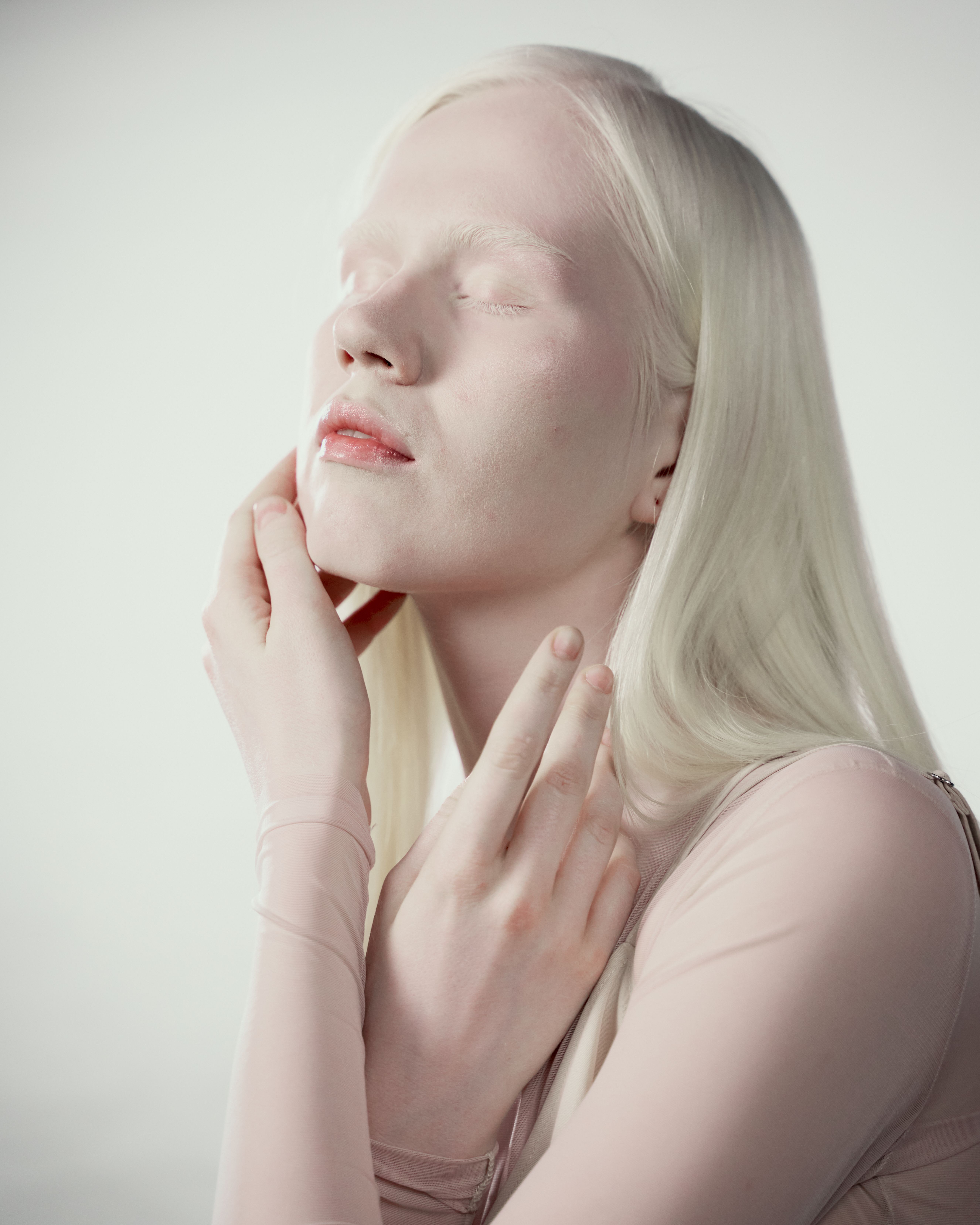 Albino Mutant Photos, Download The BEST Free Albino Mutant Stock Photos ...
