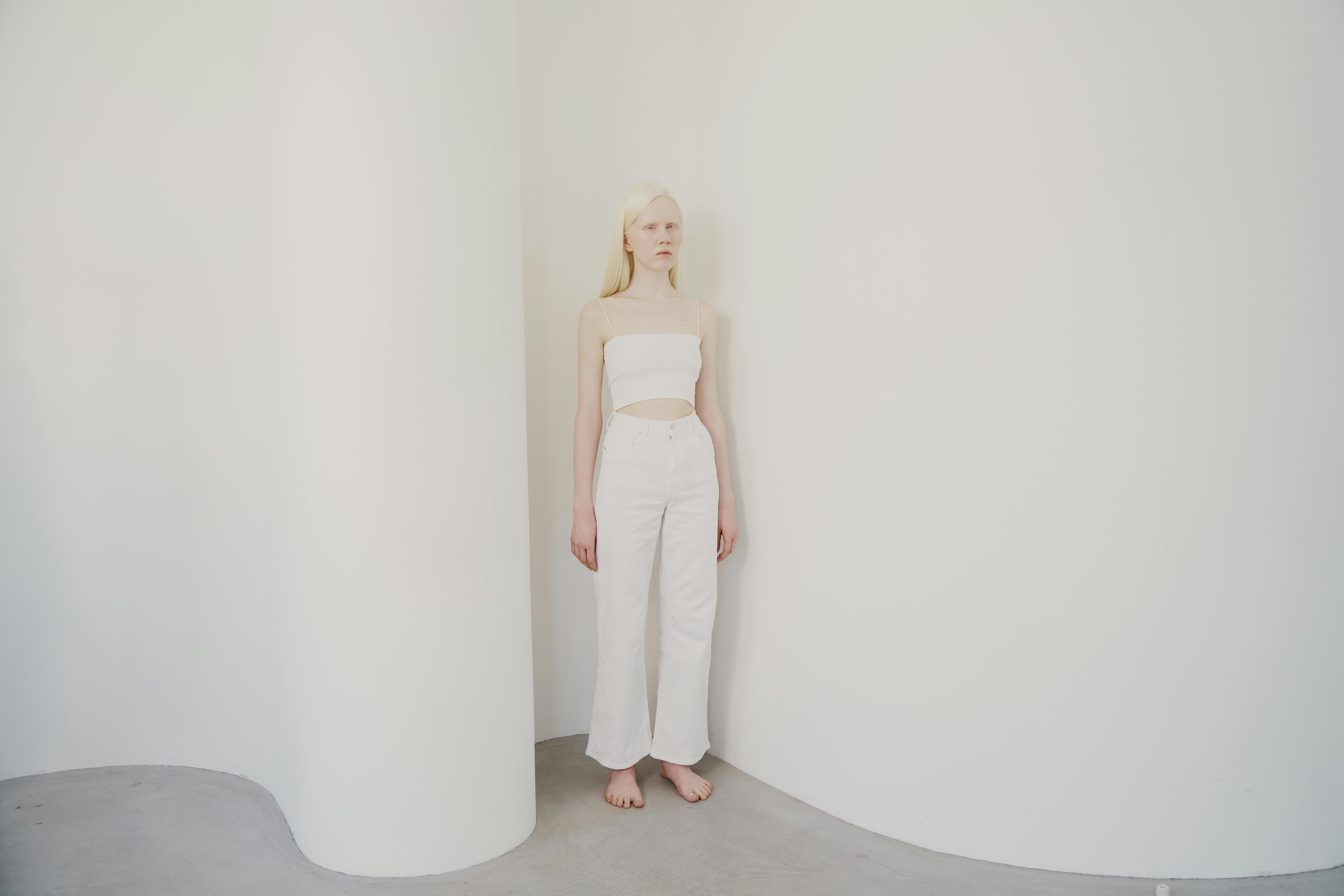 400+ Best Albino Photos · 100% Free Download · Pexels Stock Photos