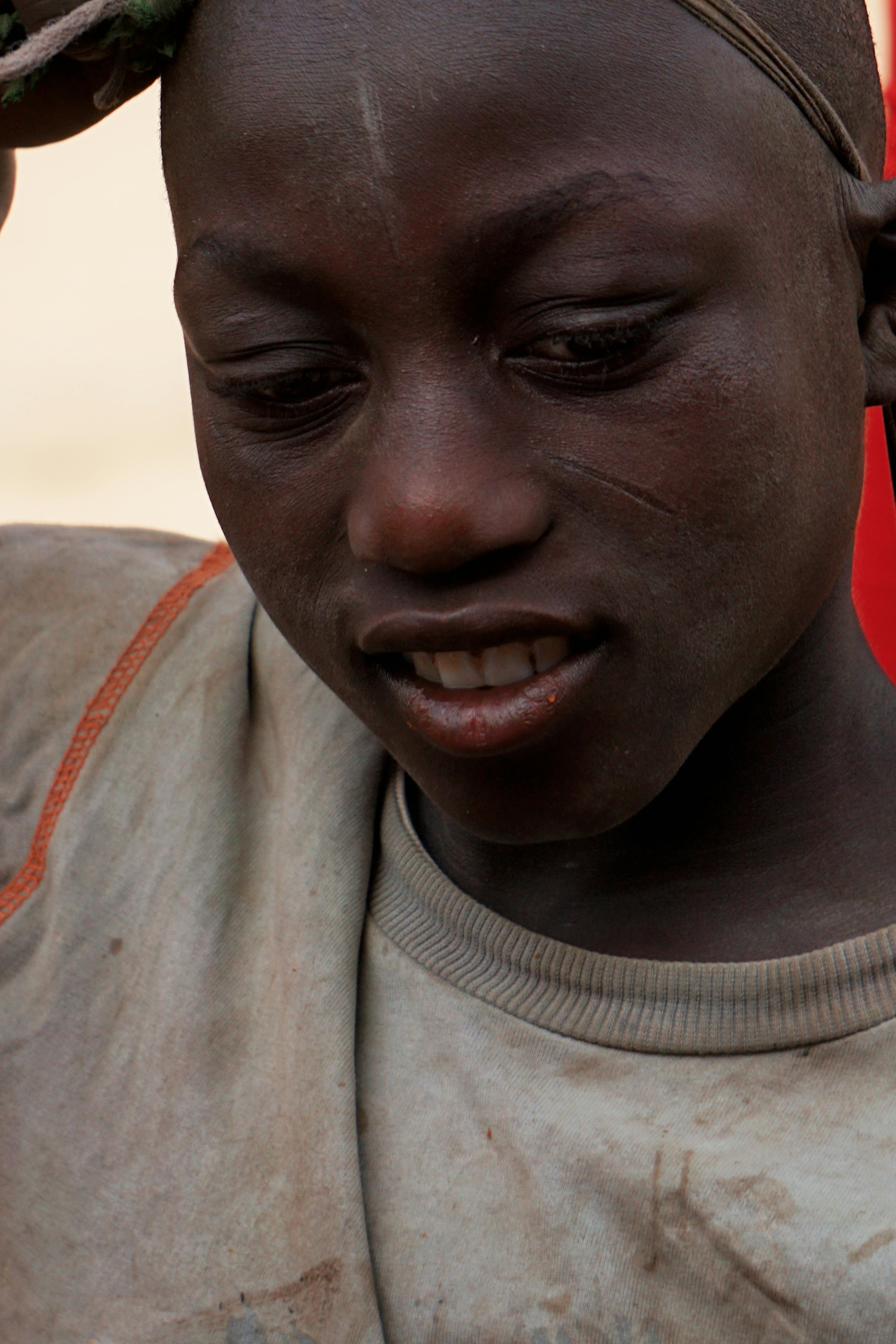 Kid With Scar Photos, Download The BEST Free Kid With Scar Stock Photos ...