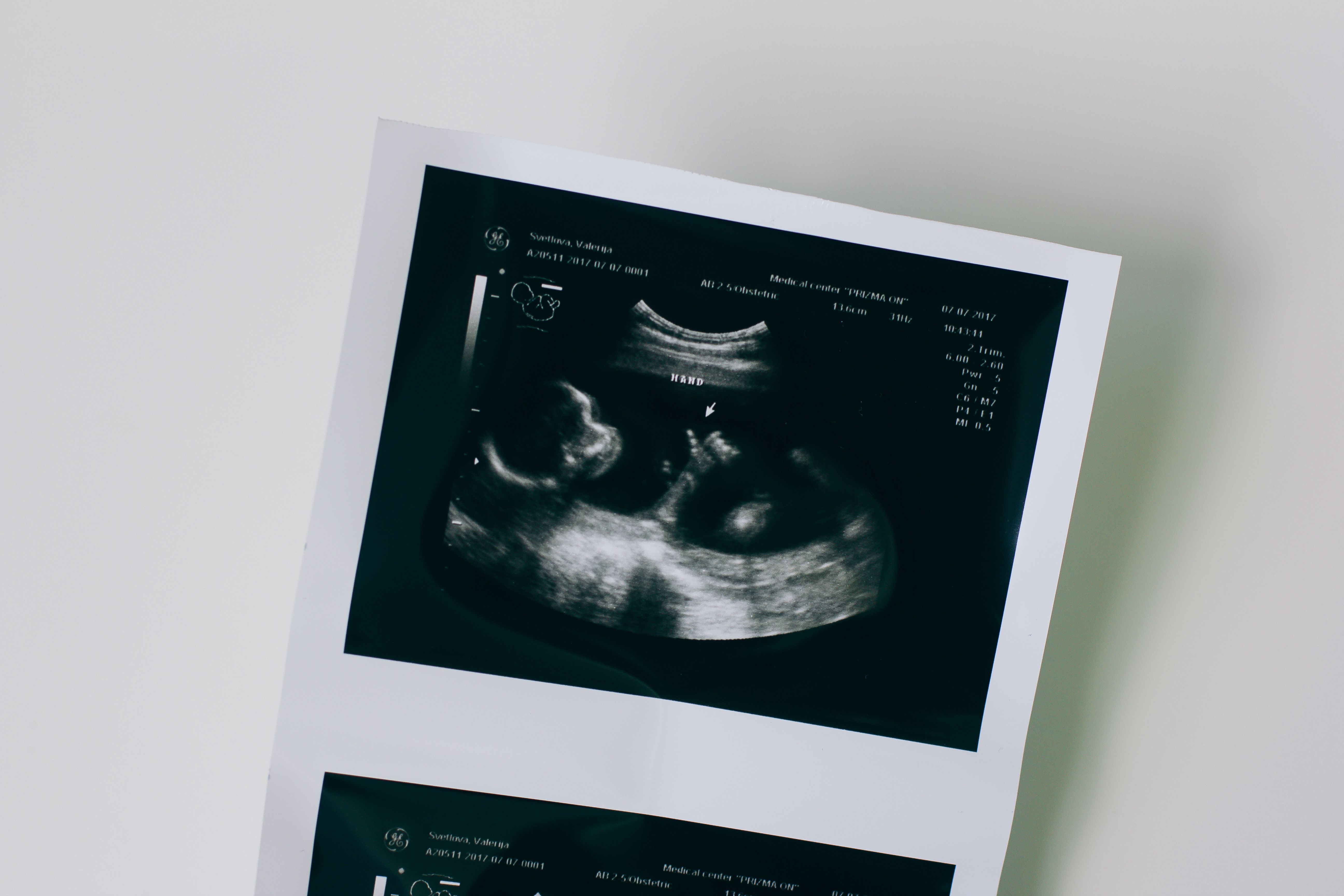 Grayscale Photo of a Person Holding an Ultrasound Result · Free Stock Photo