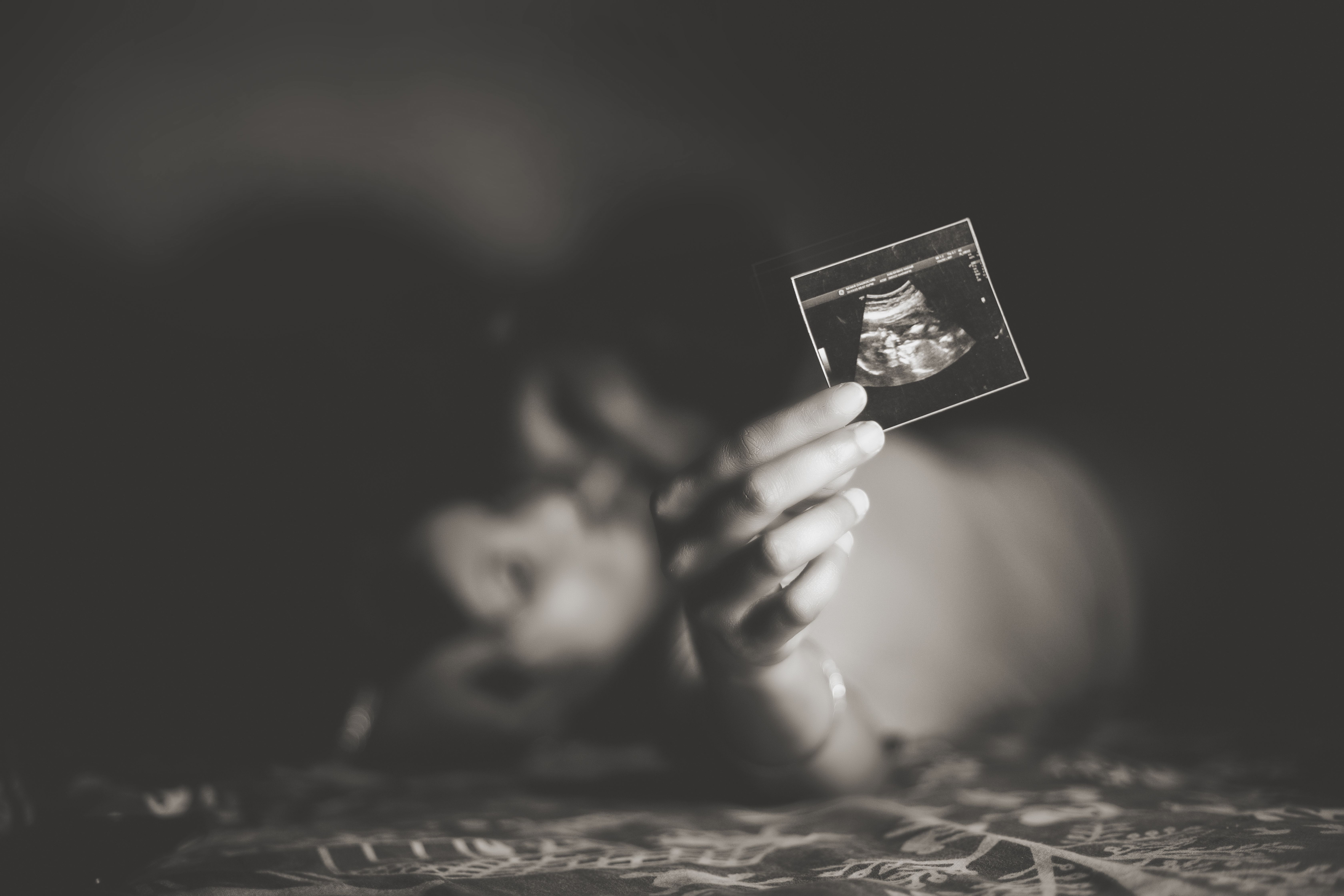 Fetality Photos, Download Free Fetality Stock Photos & HD Images