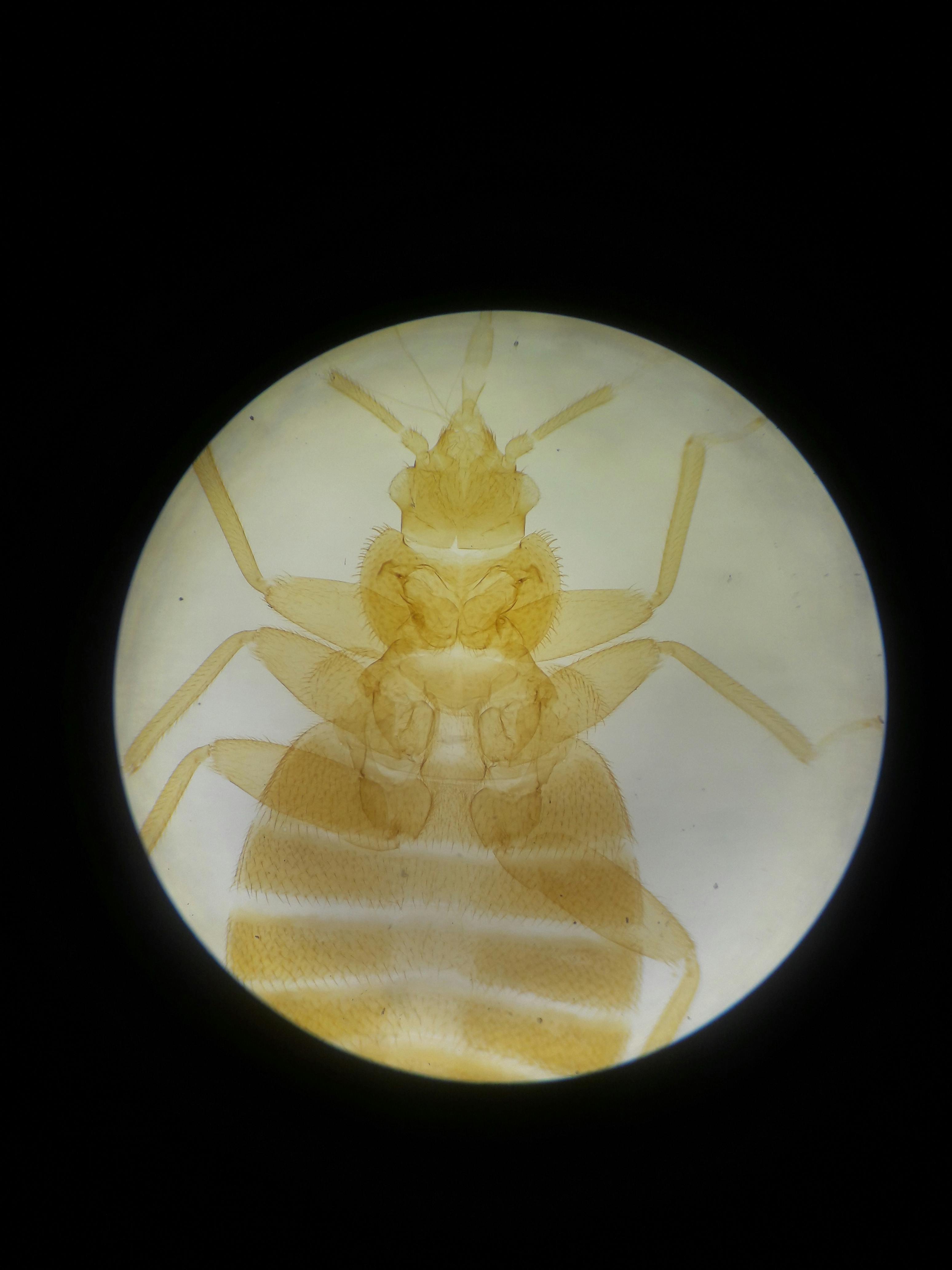 Cell Seen Under Microscope · Free Stock Photo