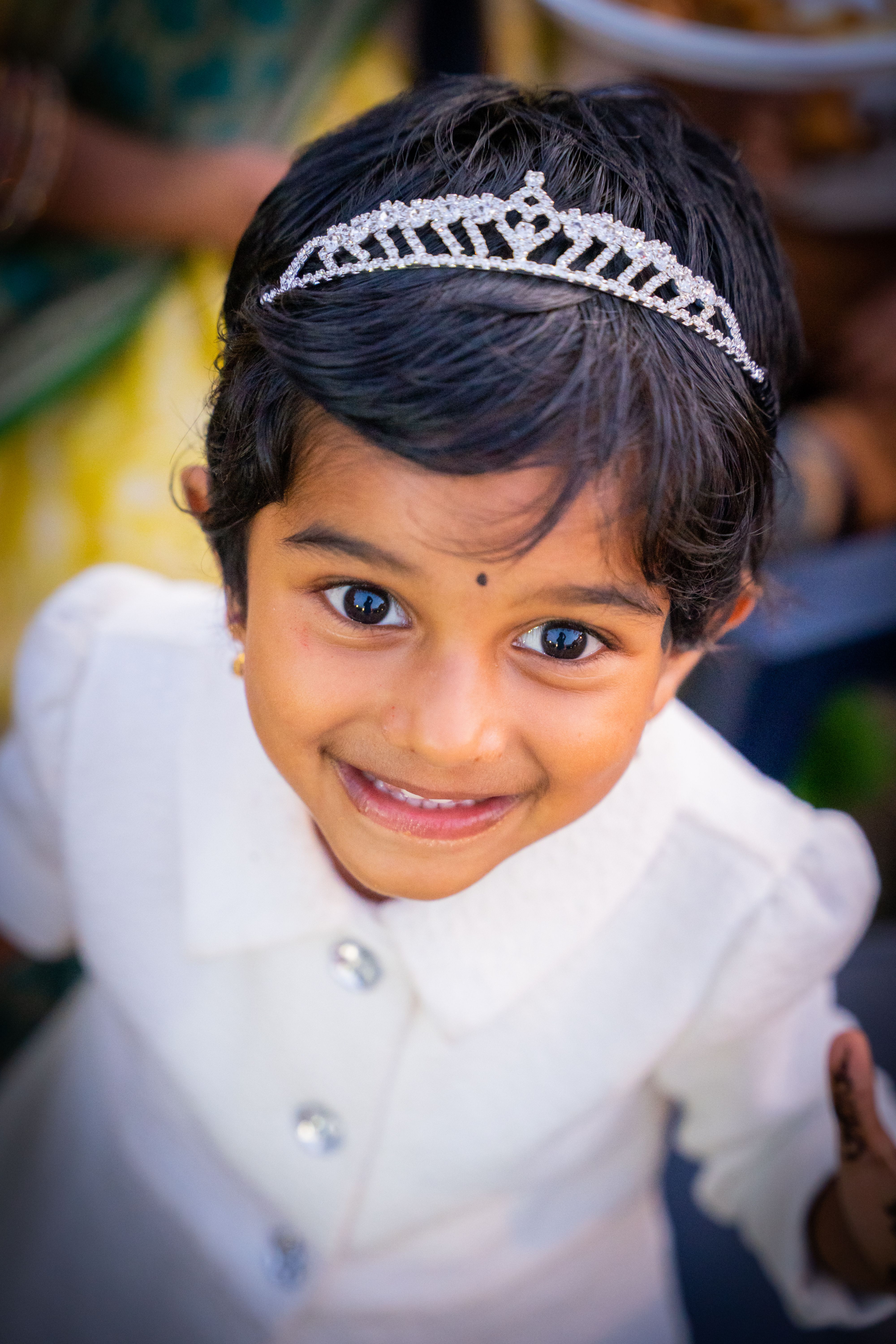 Child with Crown and Vitiligo Smiling Joyfully · Free Stock Photo