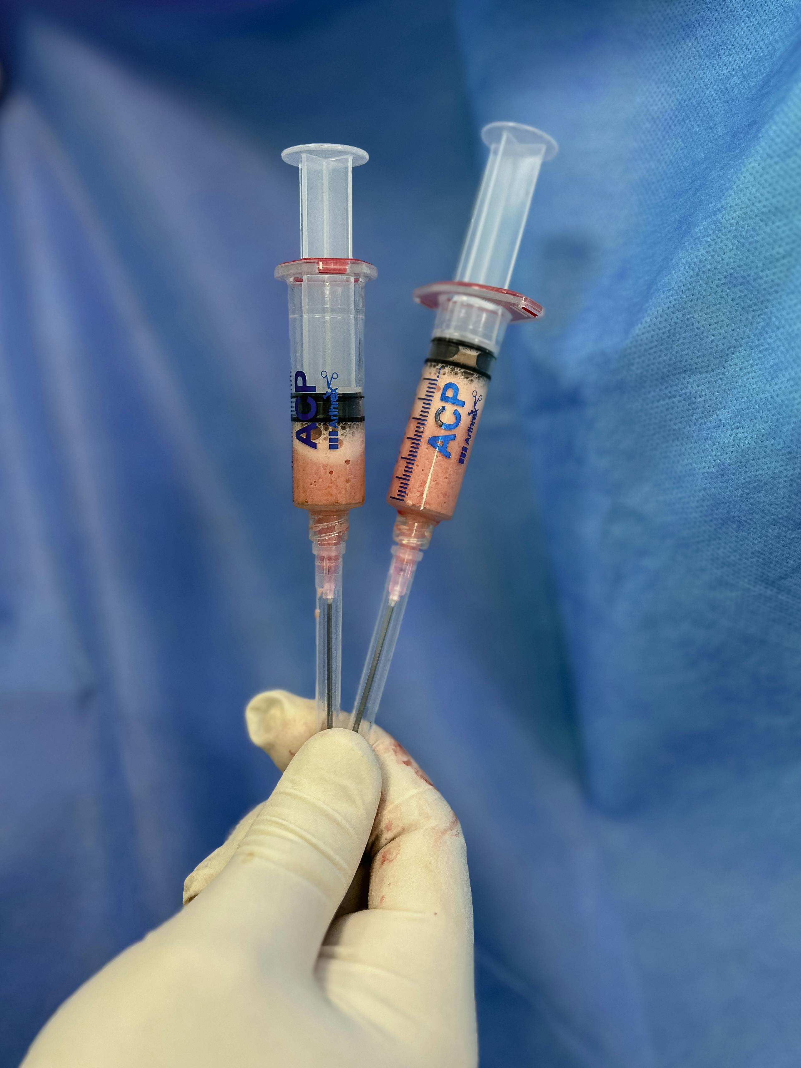 Person Getting His Blood Check · Free Stock Photo