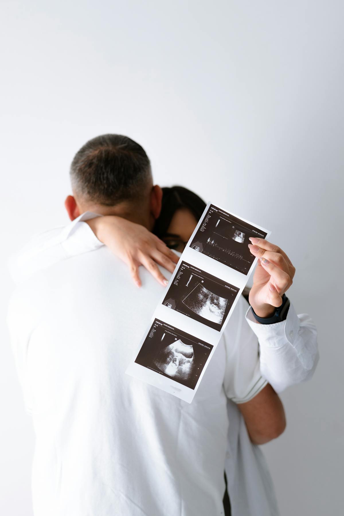 Ultrasound Print Photos, Download The BEST Free Ultrasound Print Stock ...