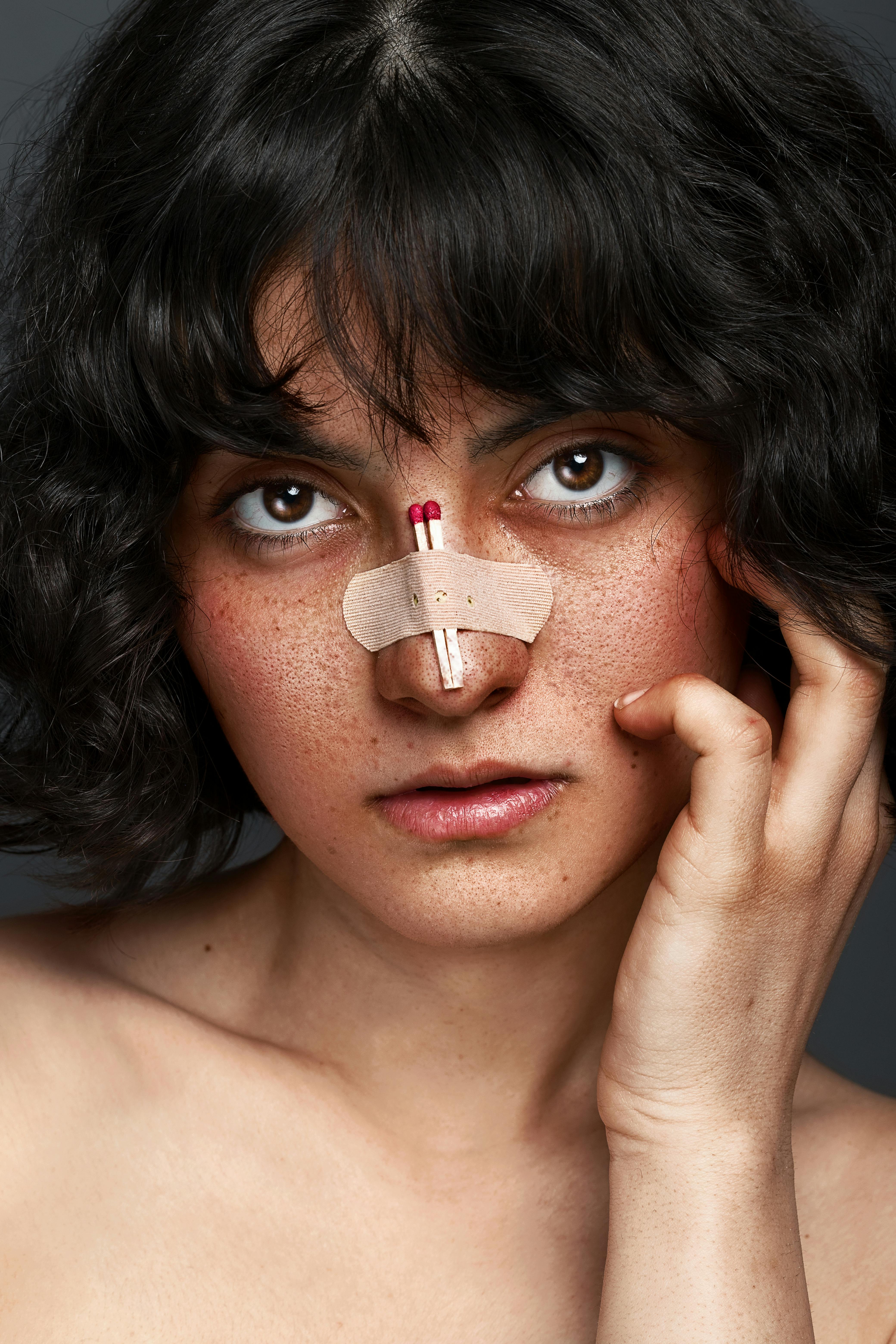 Woman with Broken Nose · Free Stock Photo