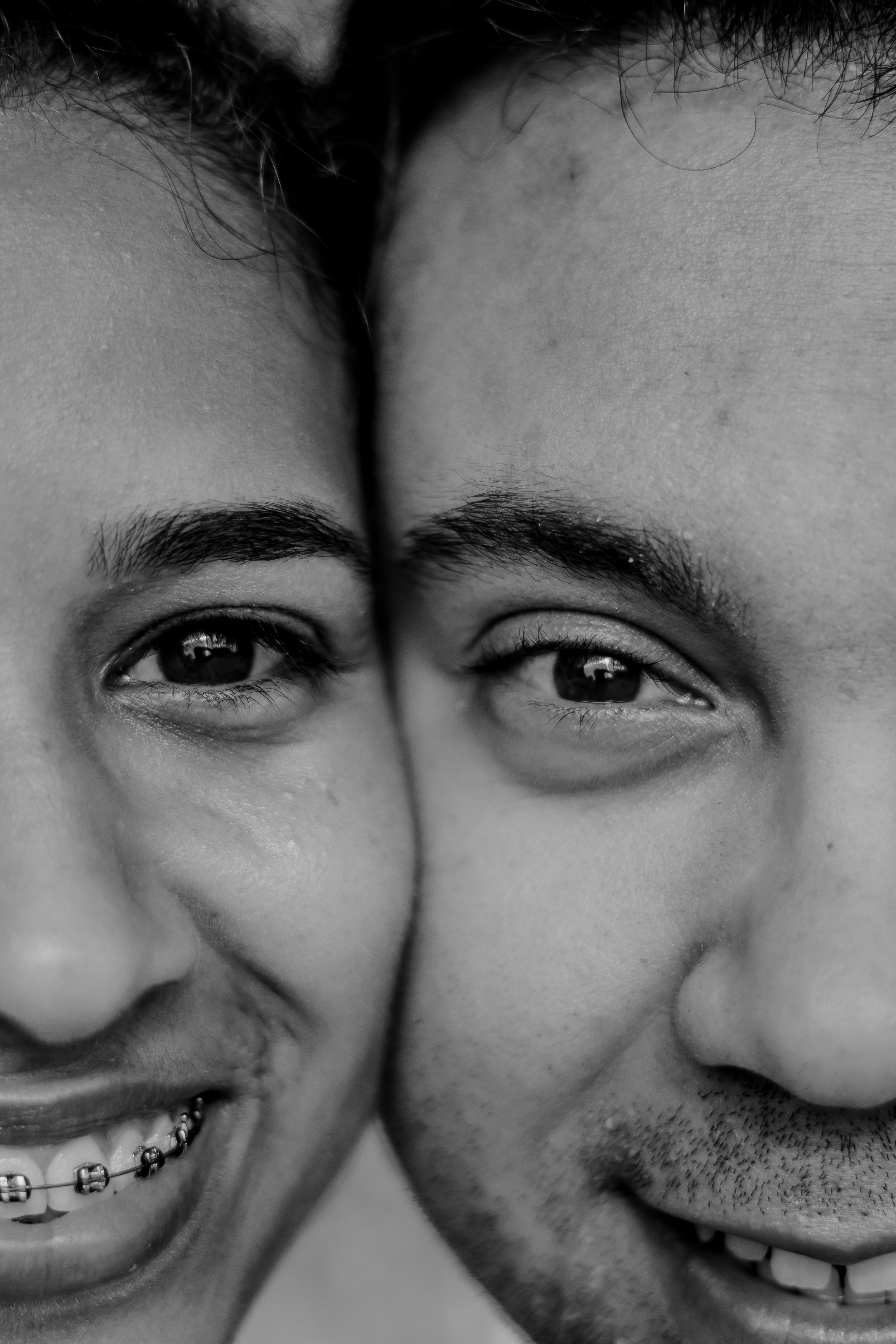 Close Up Photo of Human Cheek · Free Stock Photo