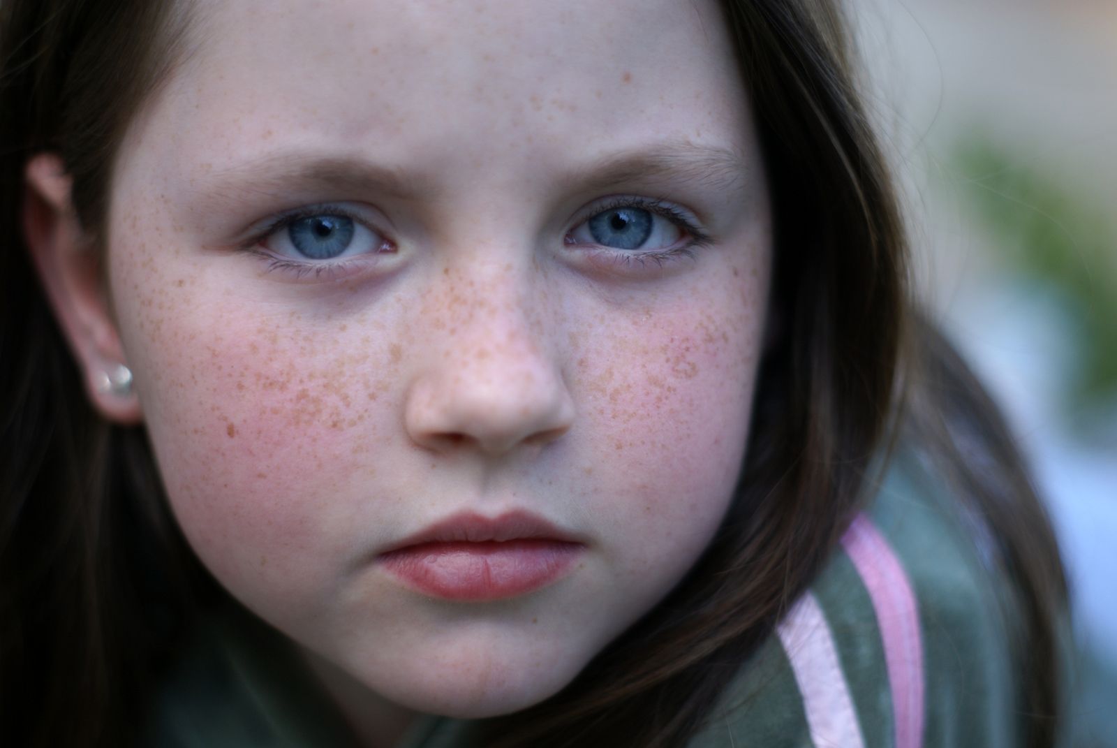 Young Girl Freckles Photos, Download The BEST Free Young Girl Freckles ...