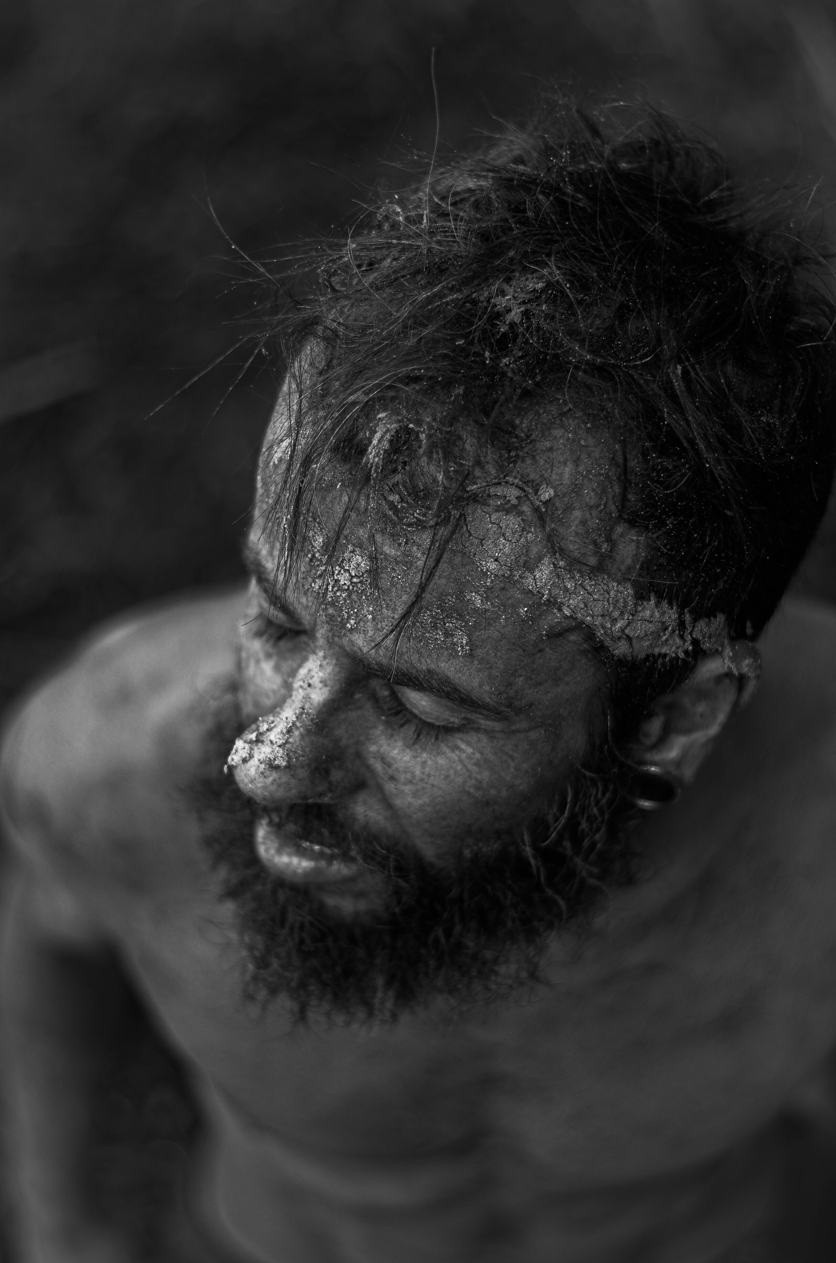 Bearded Man with a Head Injury · Free Stock Photo