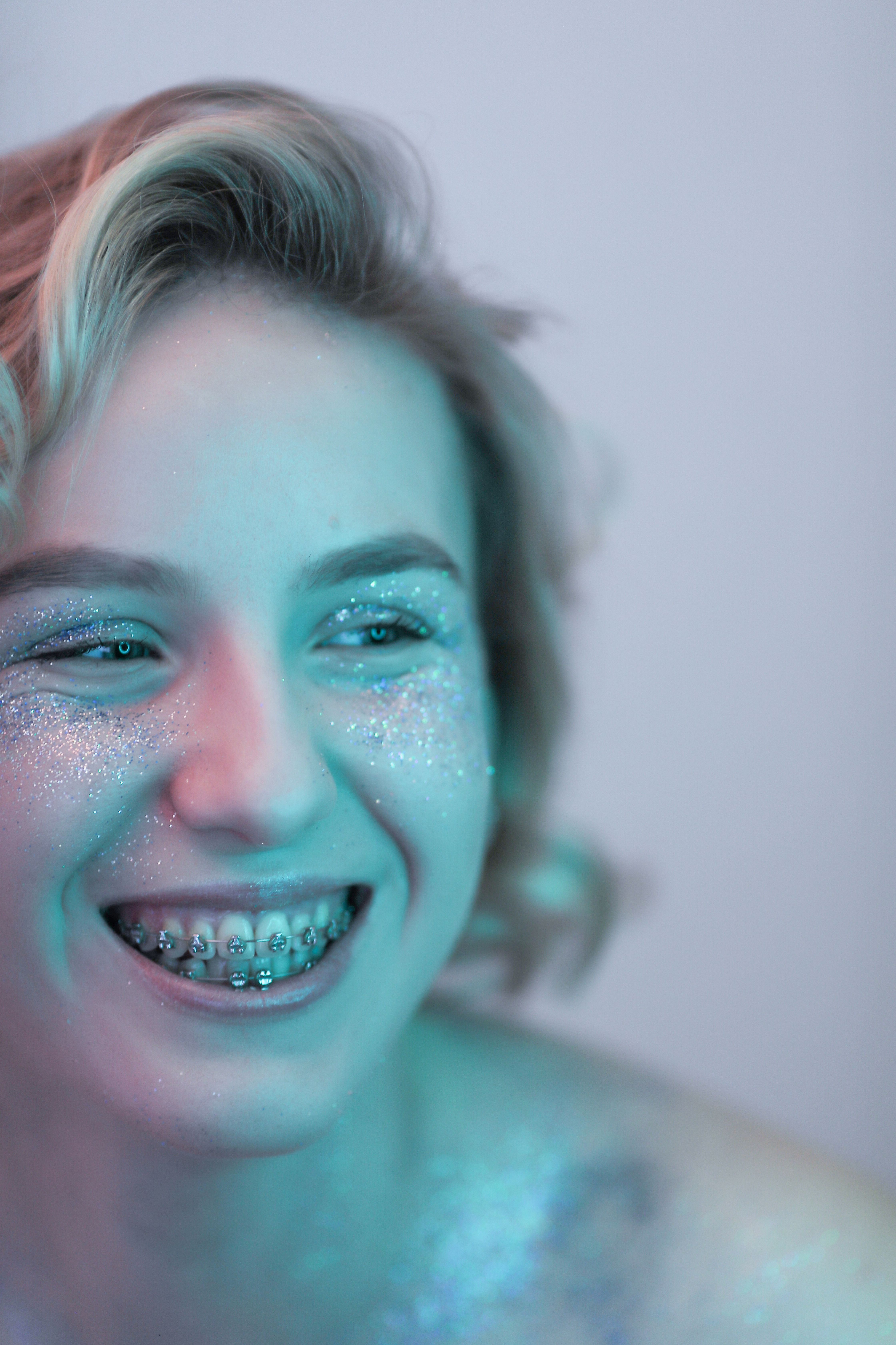 Modern Braces Dental Photos, Download The BEST Free Modern Braces ...
