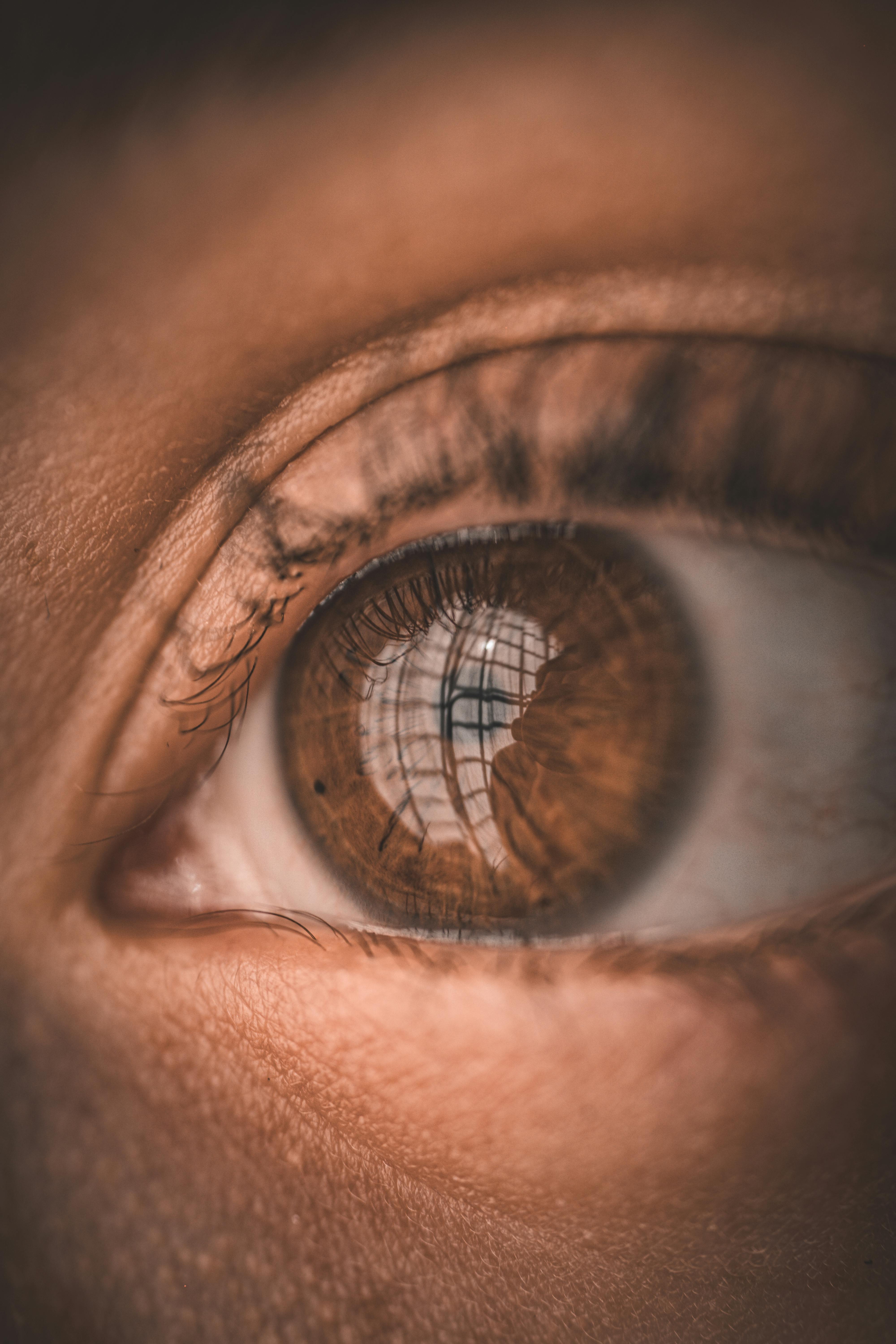 Eye Defects Photos, Download The BEST Free Eye Defects Stock Photos ...