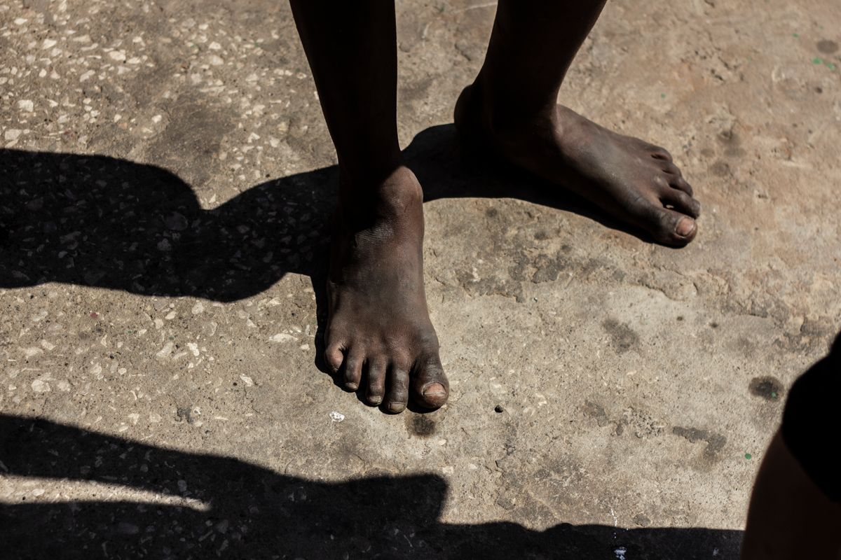 Bleeding Feet Photos, Download The BEST Free Bleeding Feet Stock Photos ...