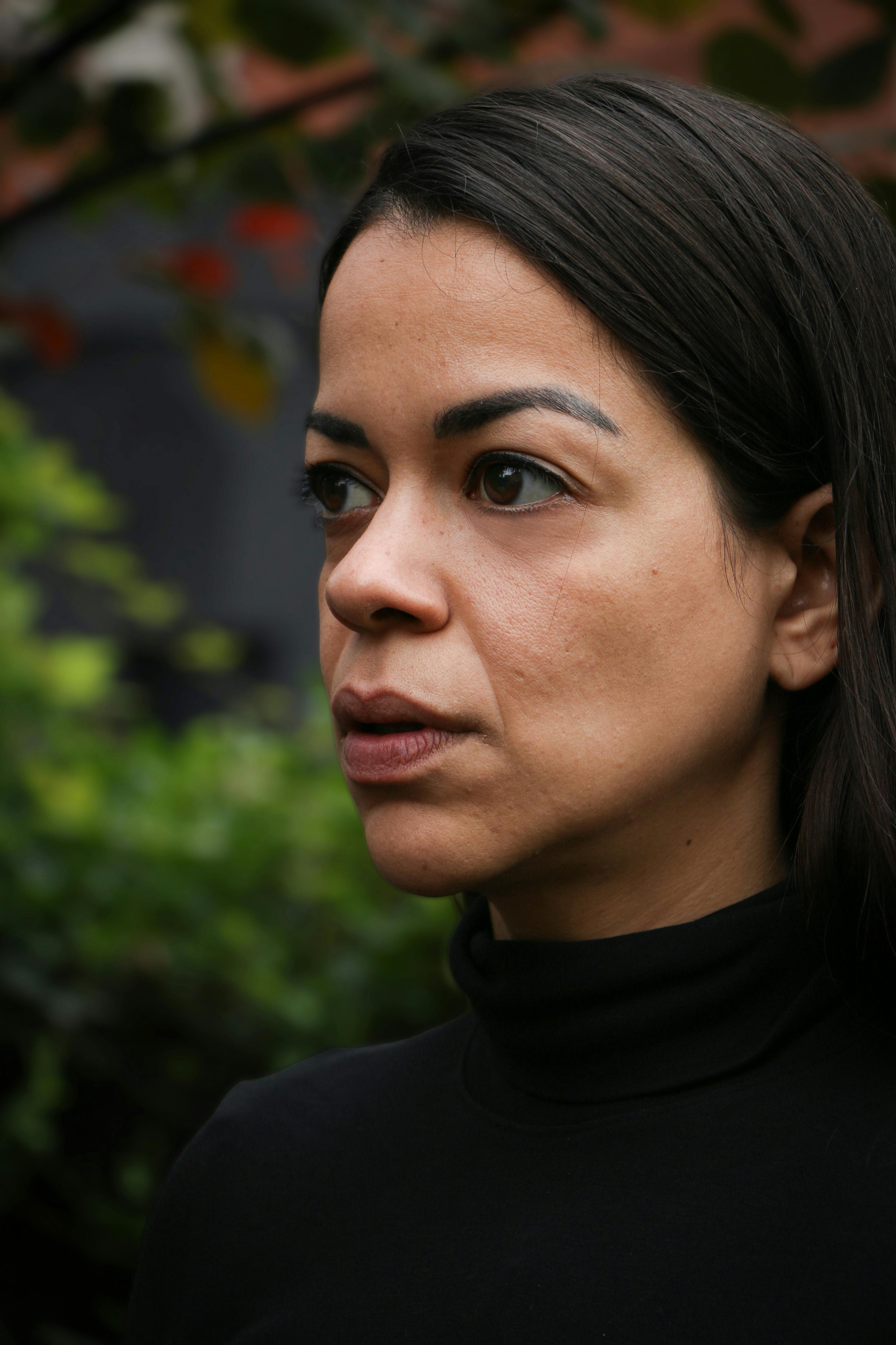 Pimples Face Model Photos, Download The BEST Free Pimples Face Model ...