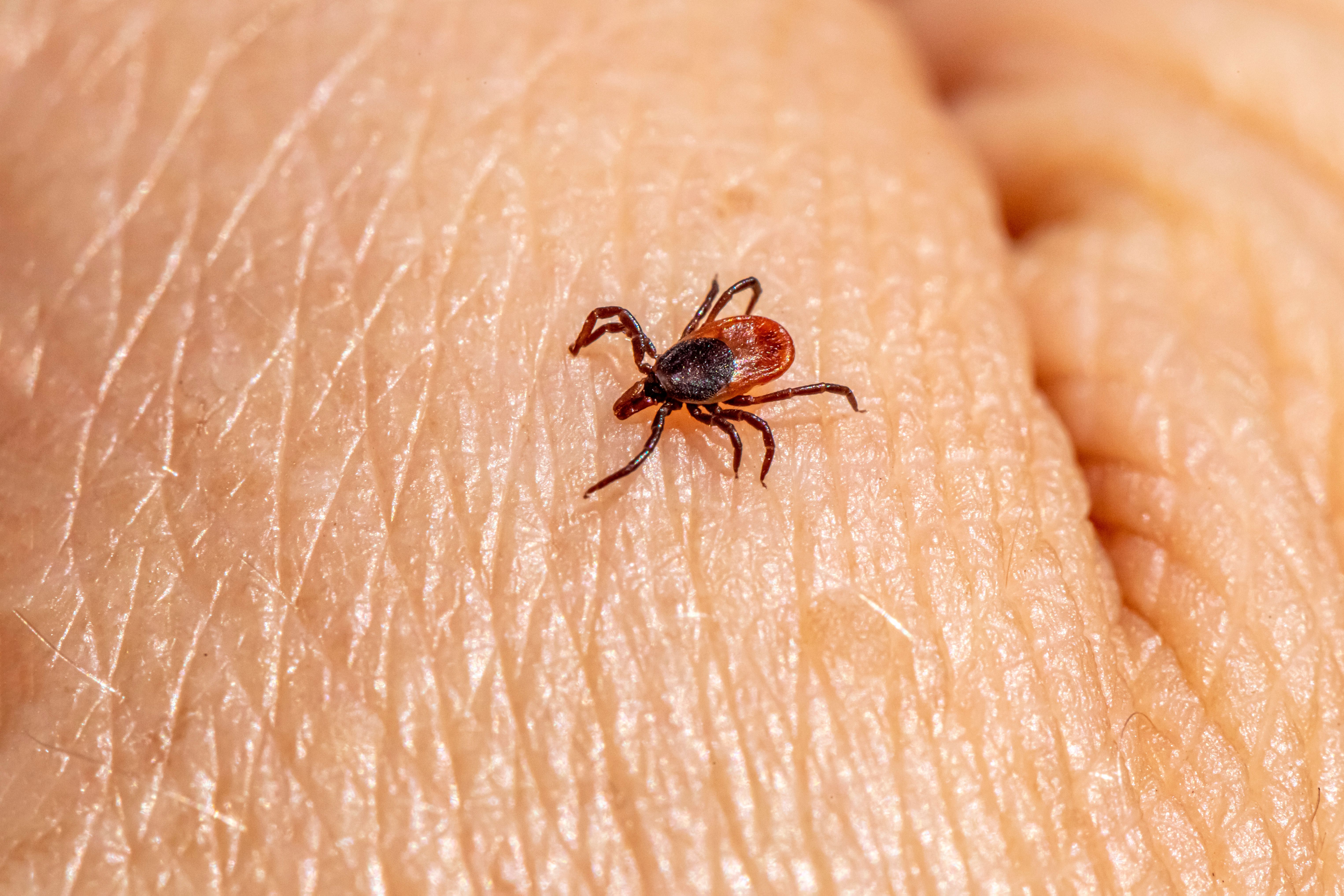 A tick on a person's skin · Free Stock Photo