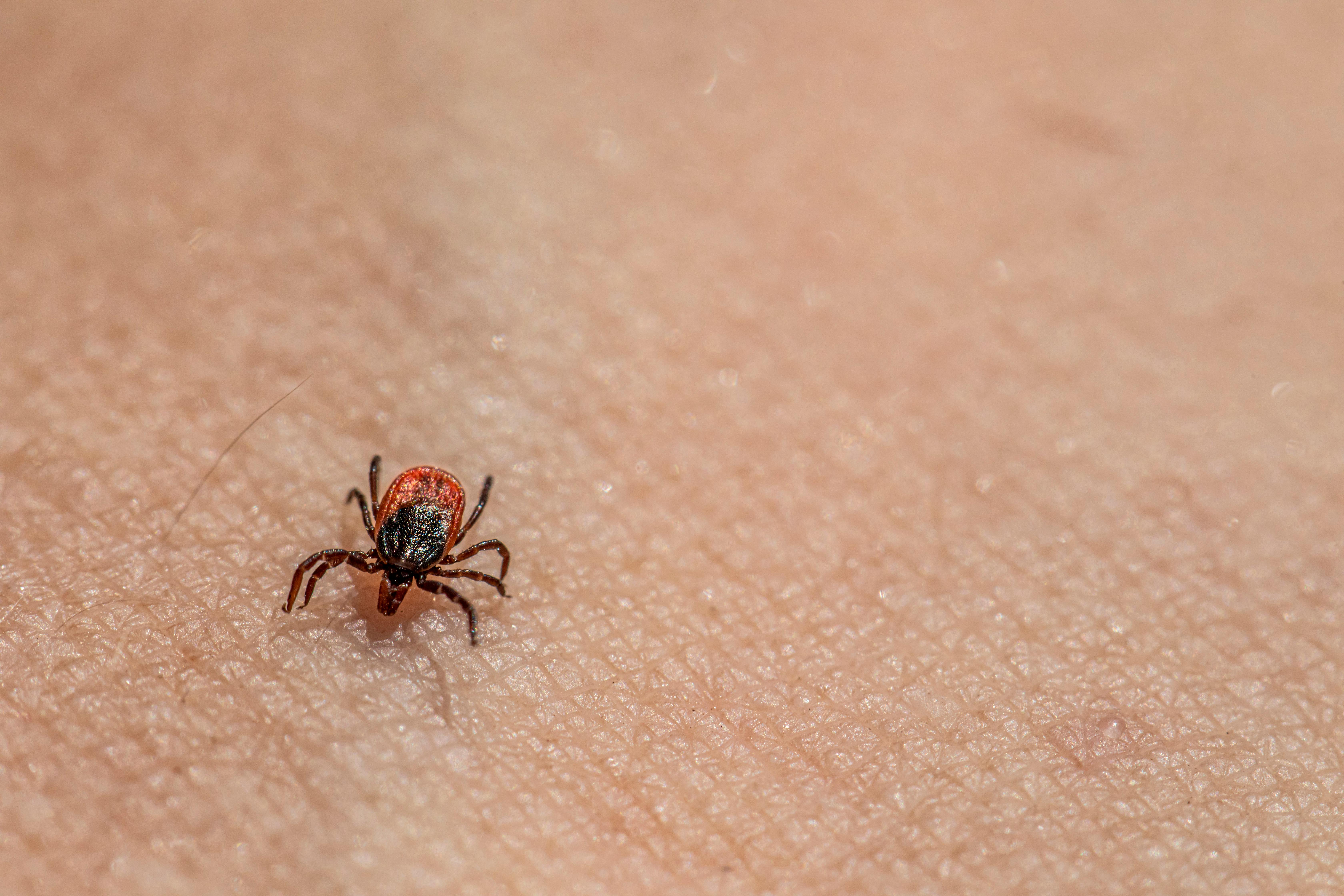 A tick is on the skin of a person · Free Stock Photo