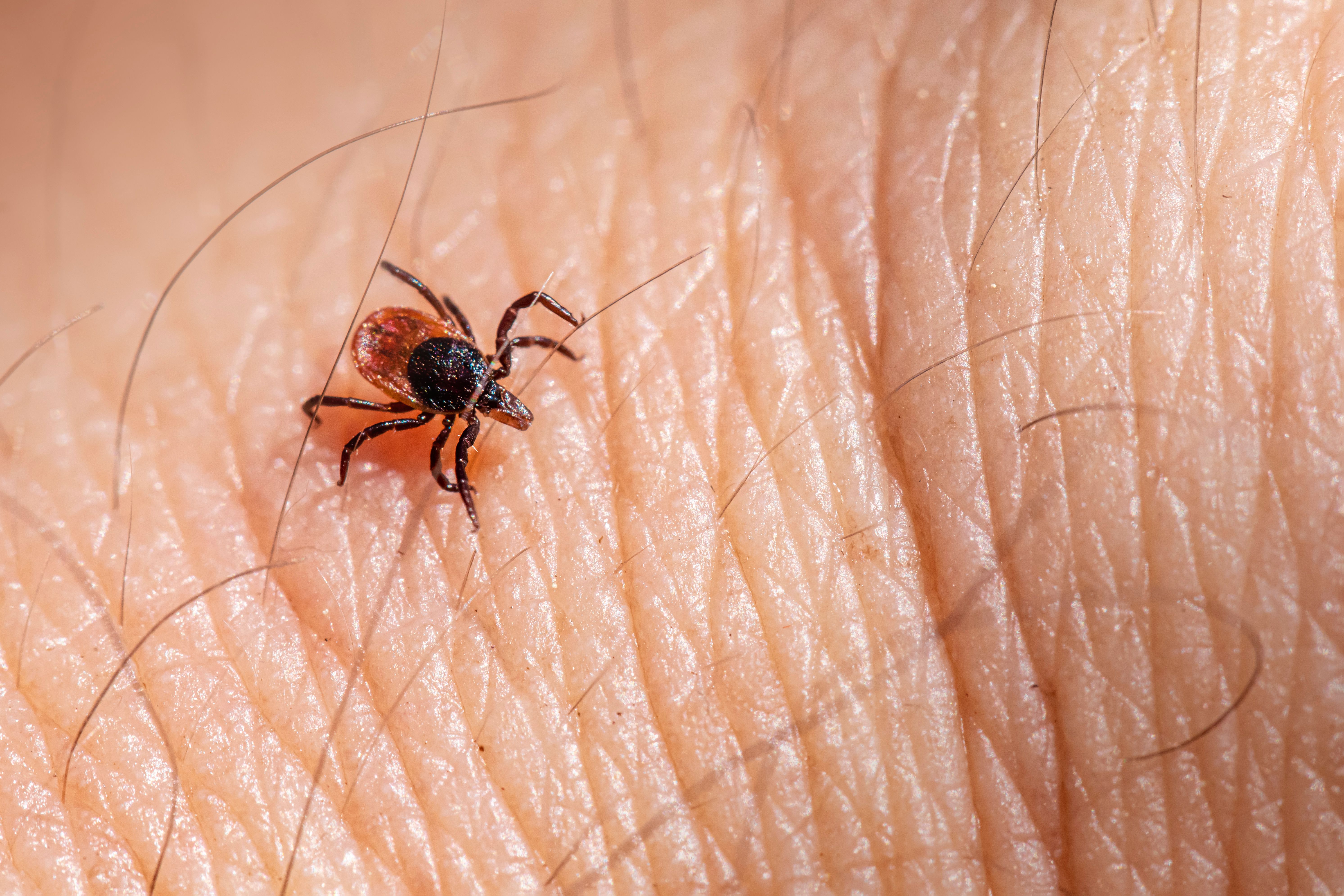 Doença De Lyme Photos, Download The BEST Free Doença De Lyme Stock ...