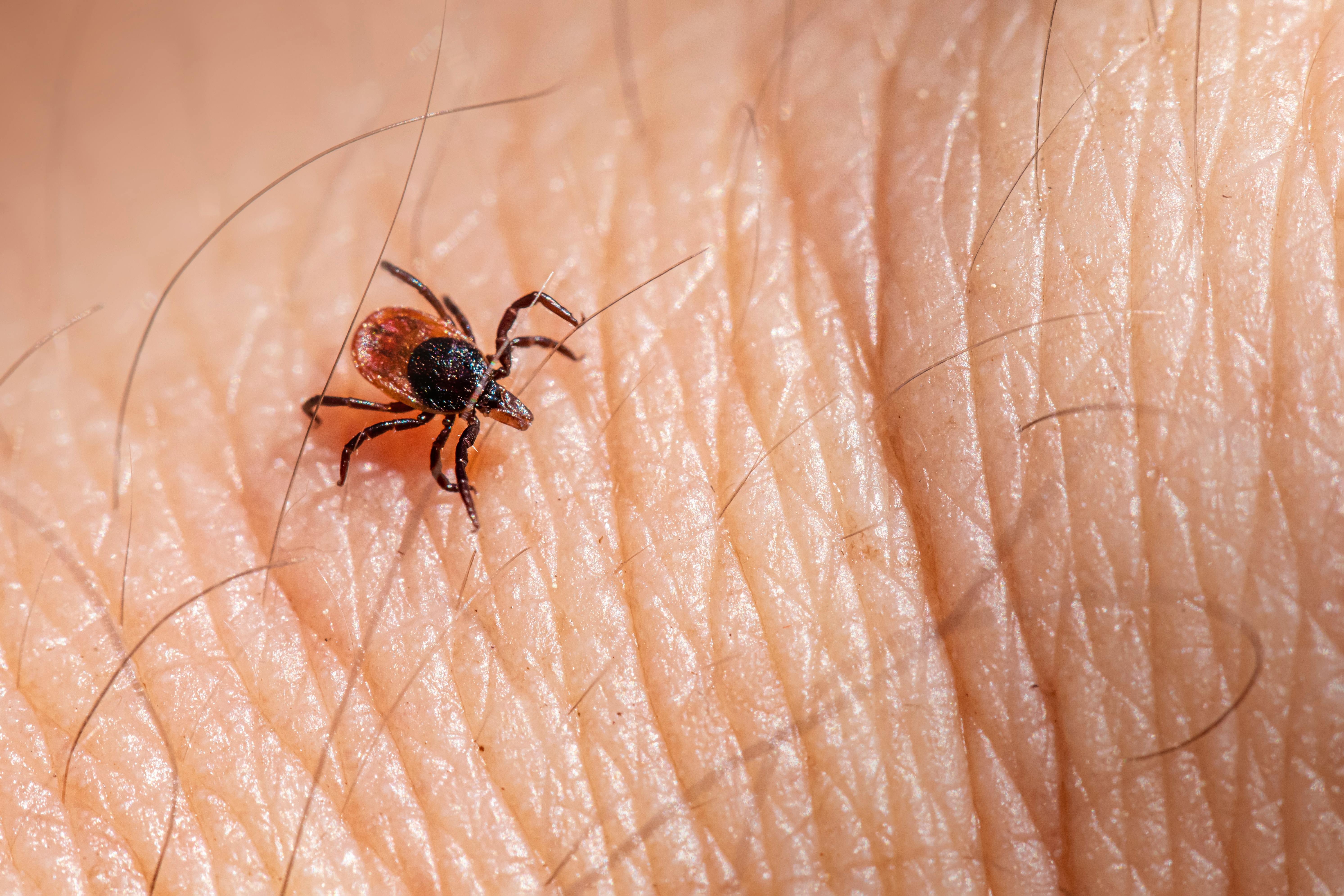 Tick Skin Photos, Download The BEST Free Tick Skin Stock Photos & HD Images