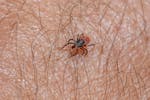 Tick Image Photos, Download The BEST Free Tick Image Stock Photos & HD ...