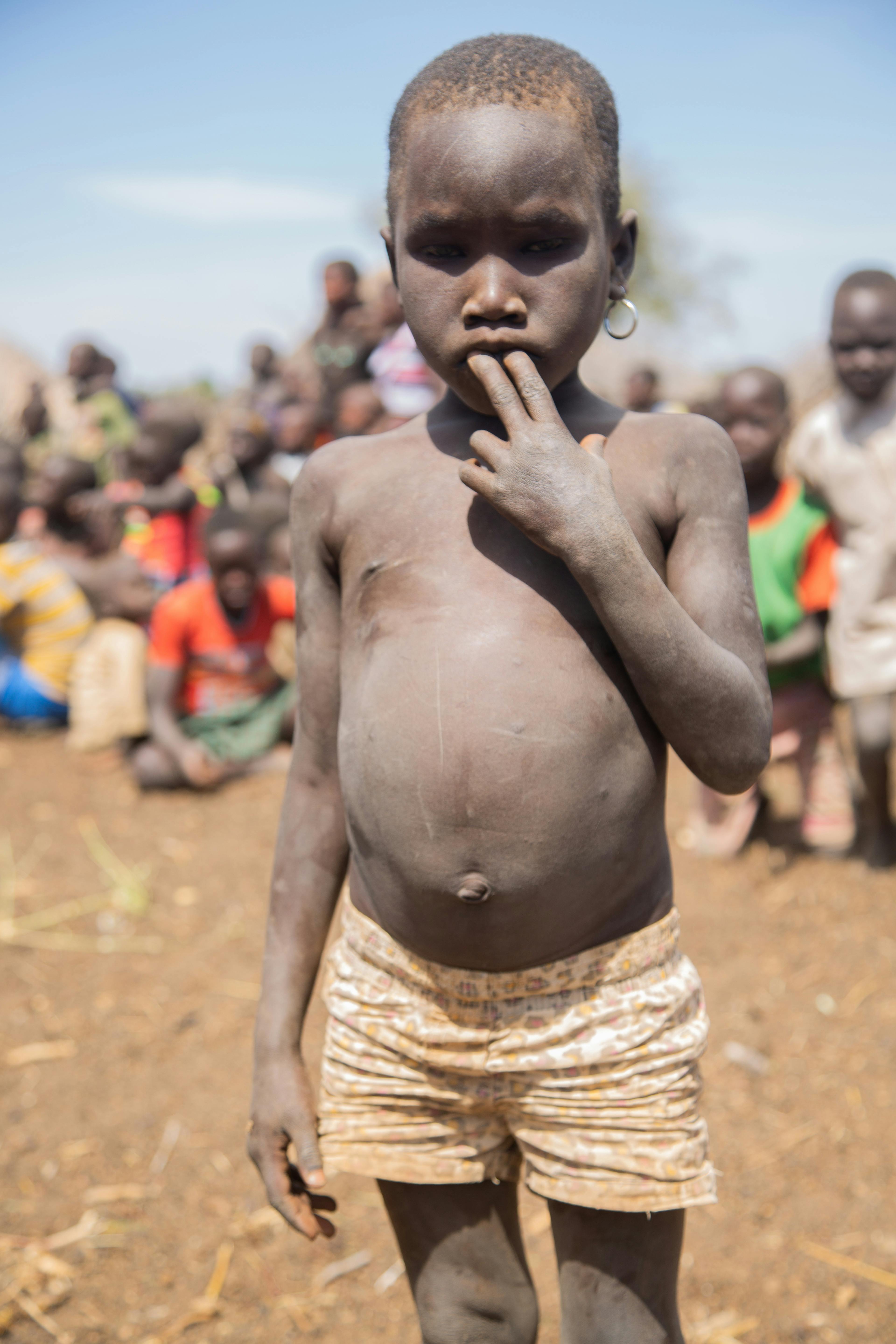 Small Child Covered in Dust with a Distended Belly · Free Stock Photo