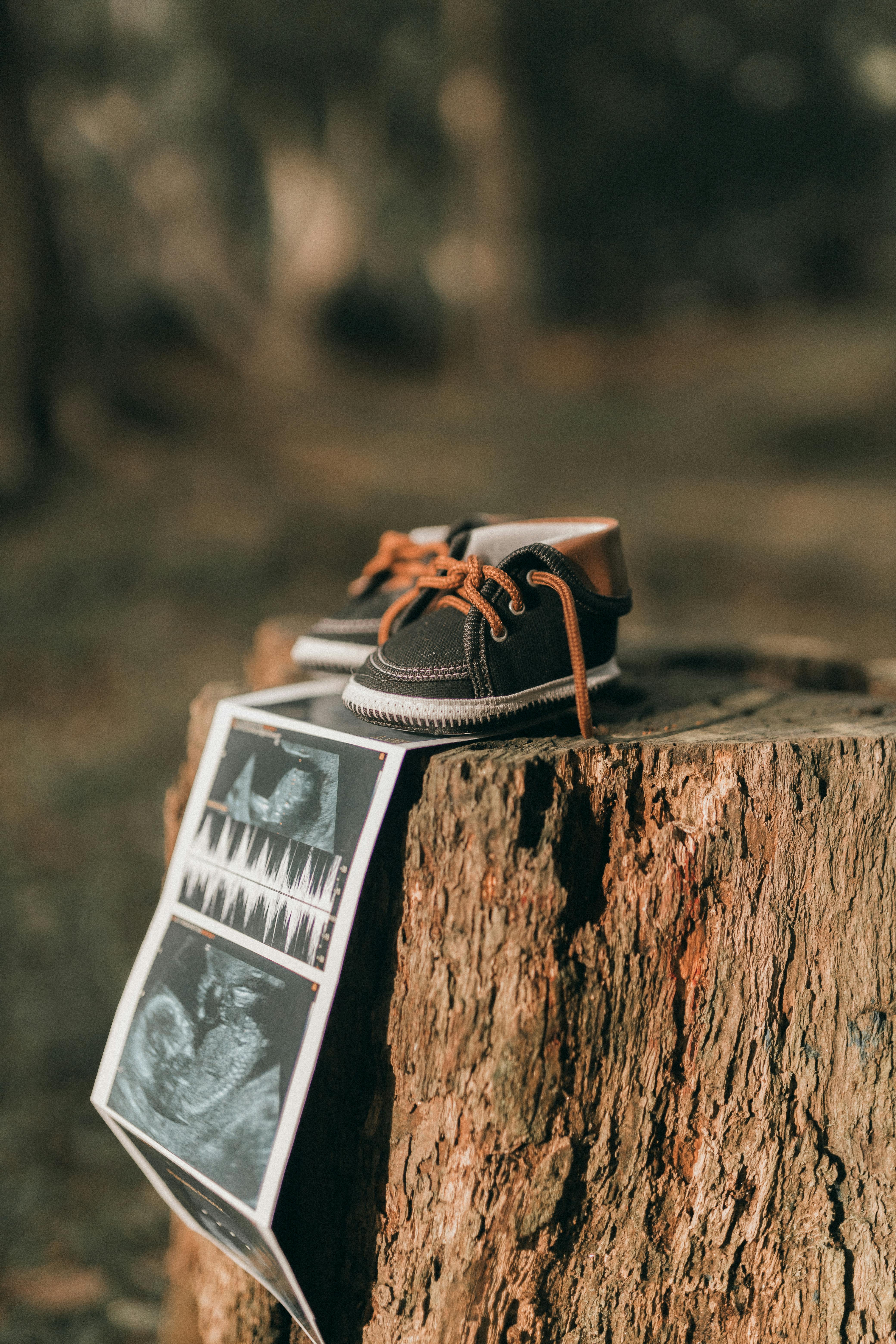 Adorable Shoes with Fetus Ultrasound on Stump · Free Stock Photo