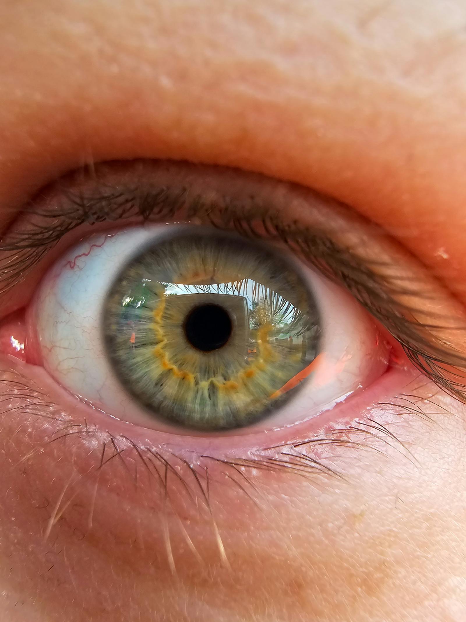Yellow Pupils Photos, Download The BEST Free Yellow Pupils Stock Photos ...