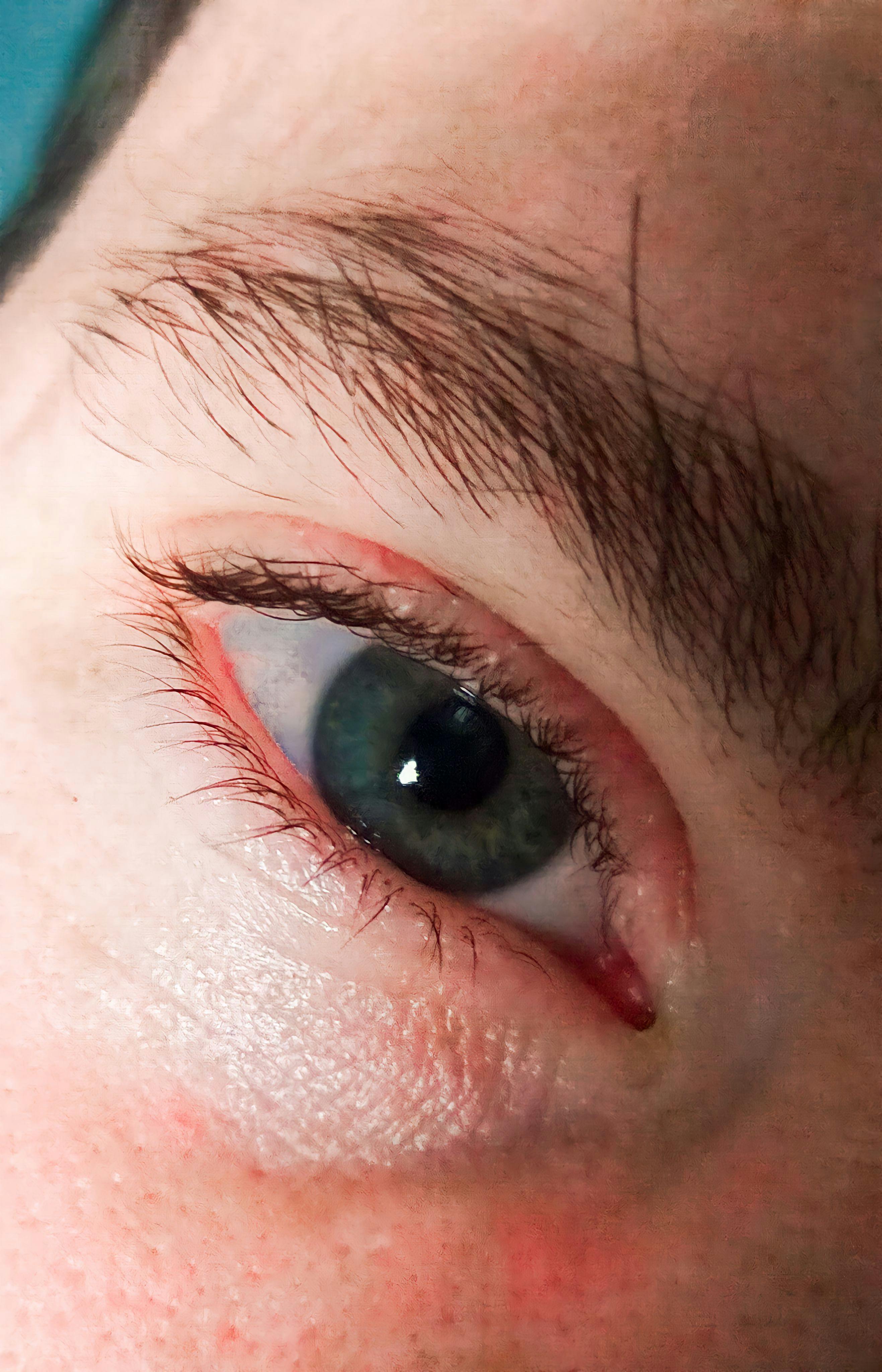 Lebra Llanera - Photography