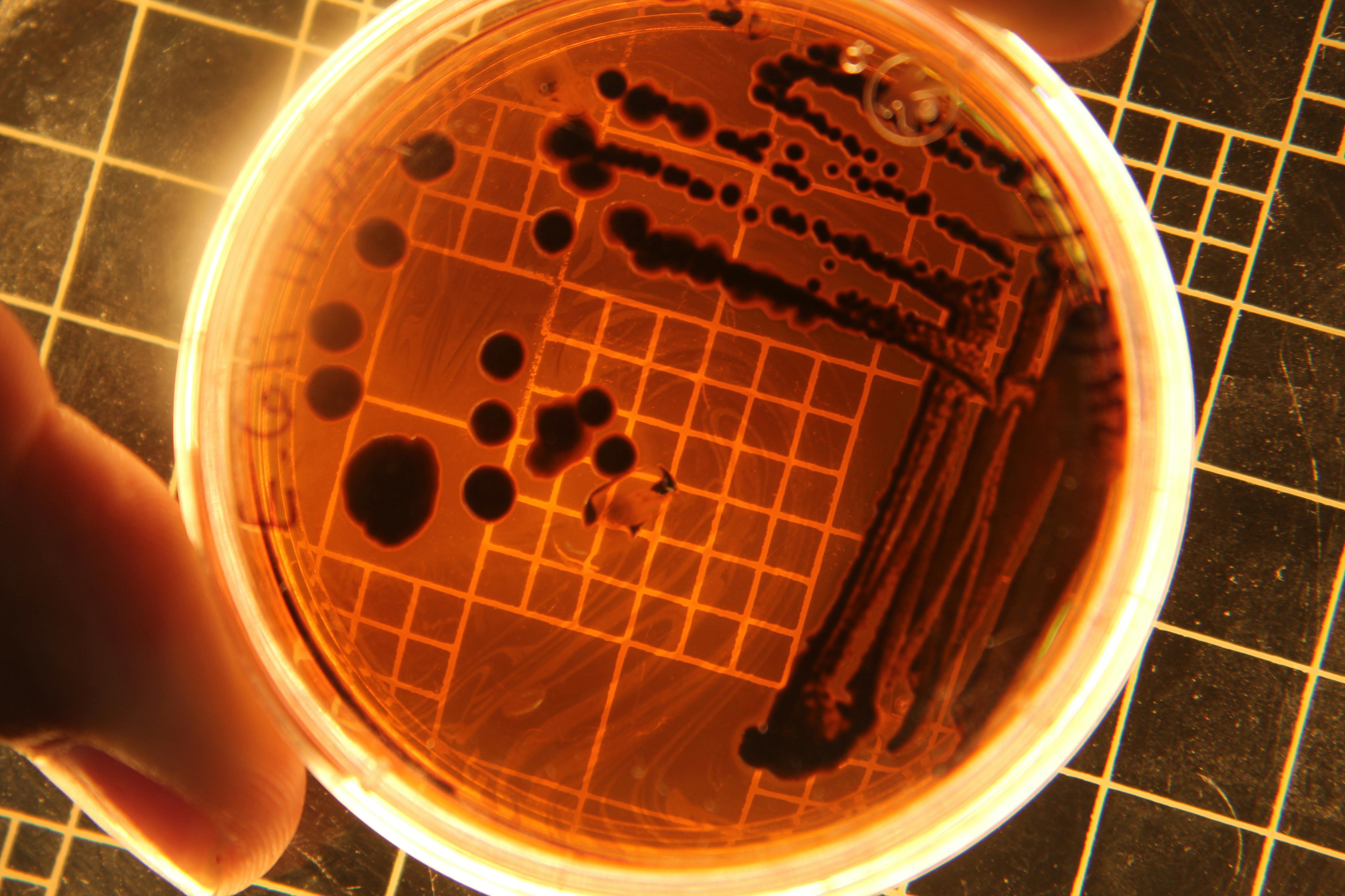 Bacterial Colonies Shown Under a Light · Free Stock Photo