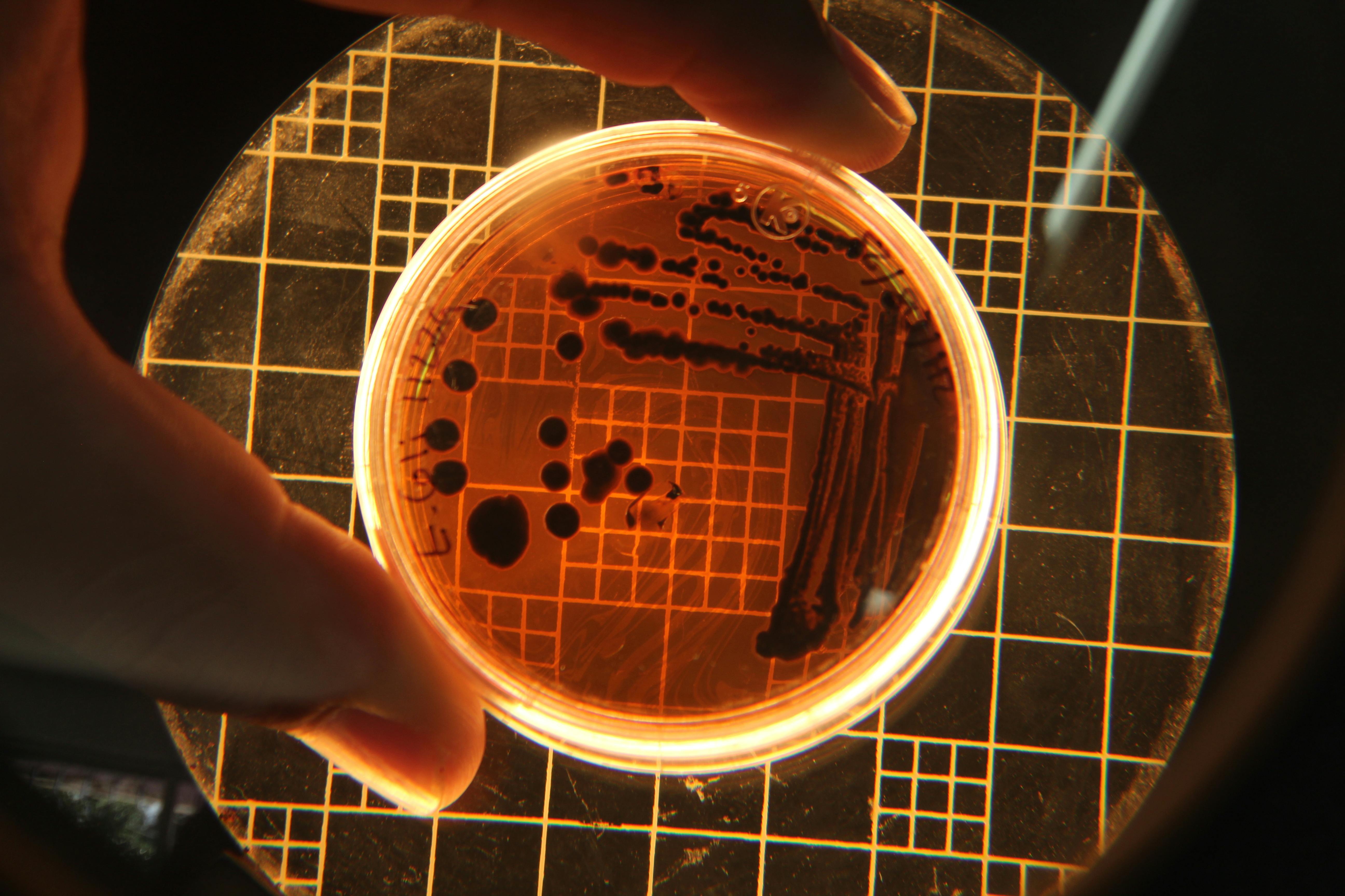 Bacterial Colonies Shown Under a Light · Free Stock Photo