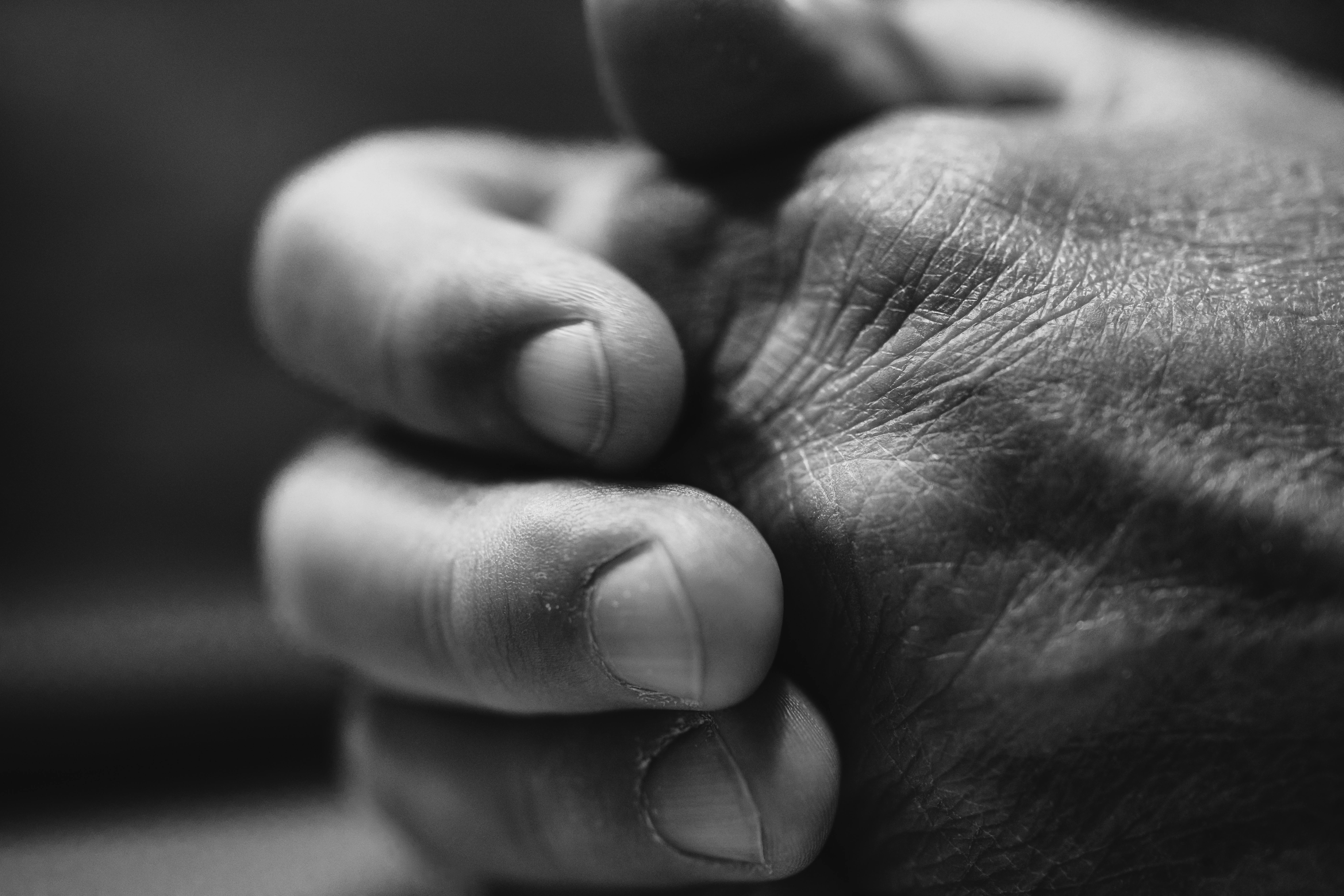 Close-up Photo Of A Person,s Hand Scratching On His Flaky Skin In Black ...