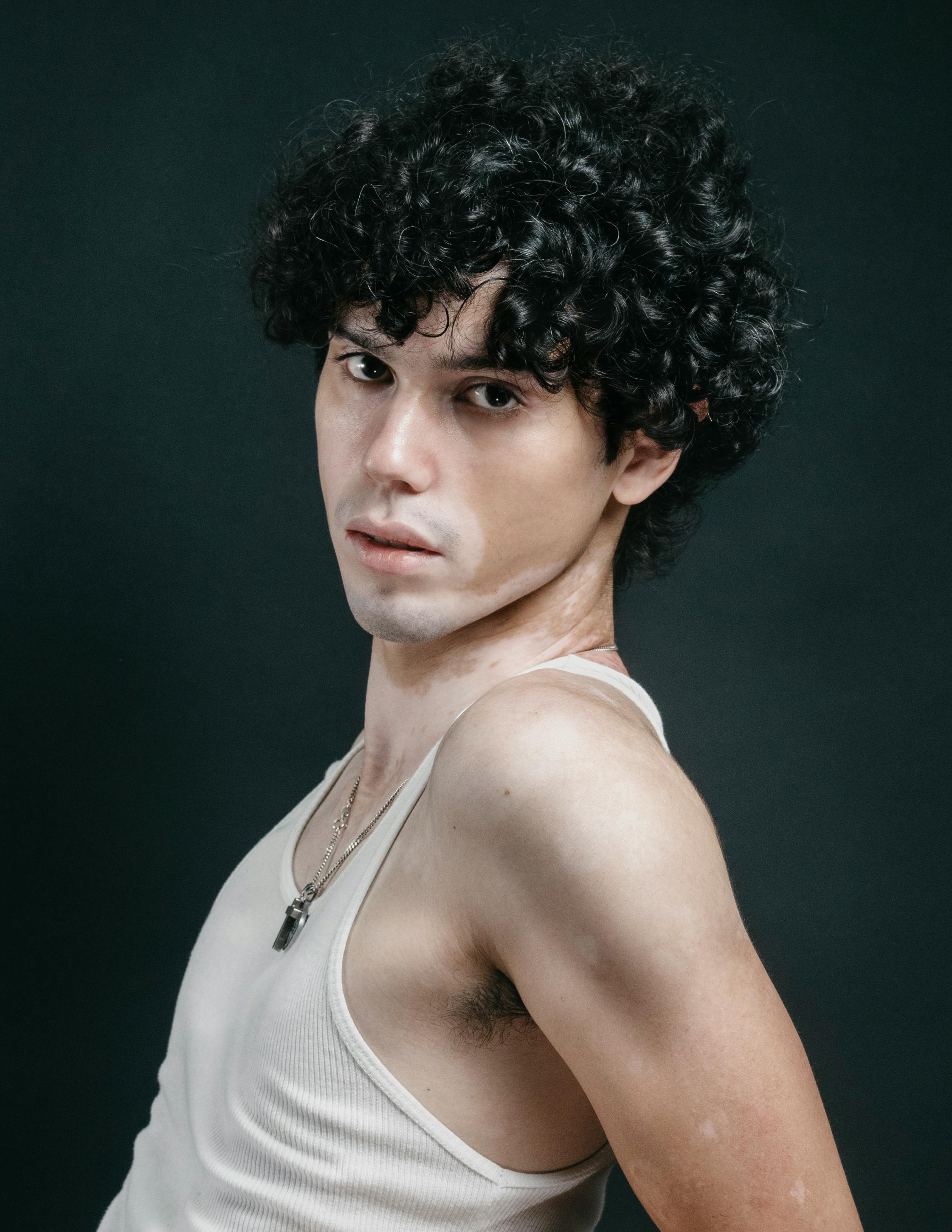 Vitiligo Boy · Free Stock Photo