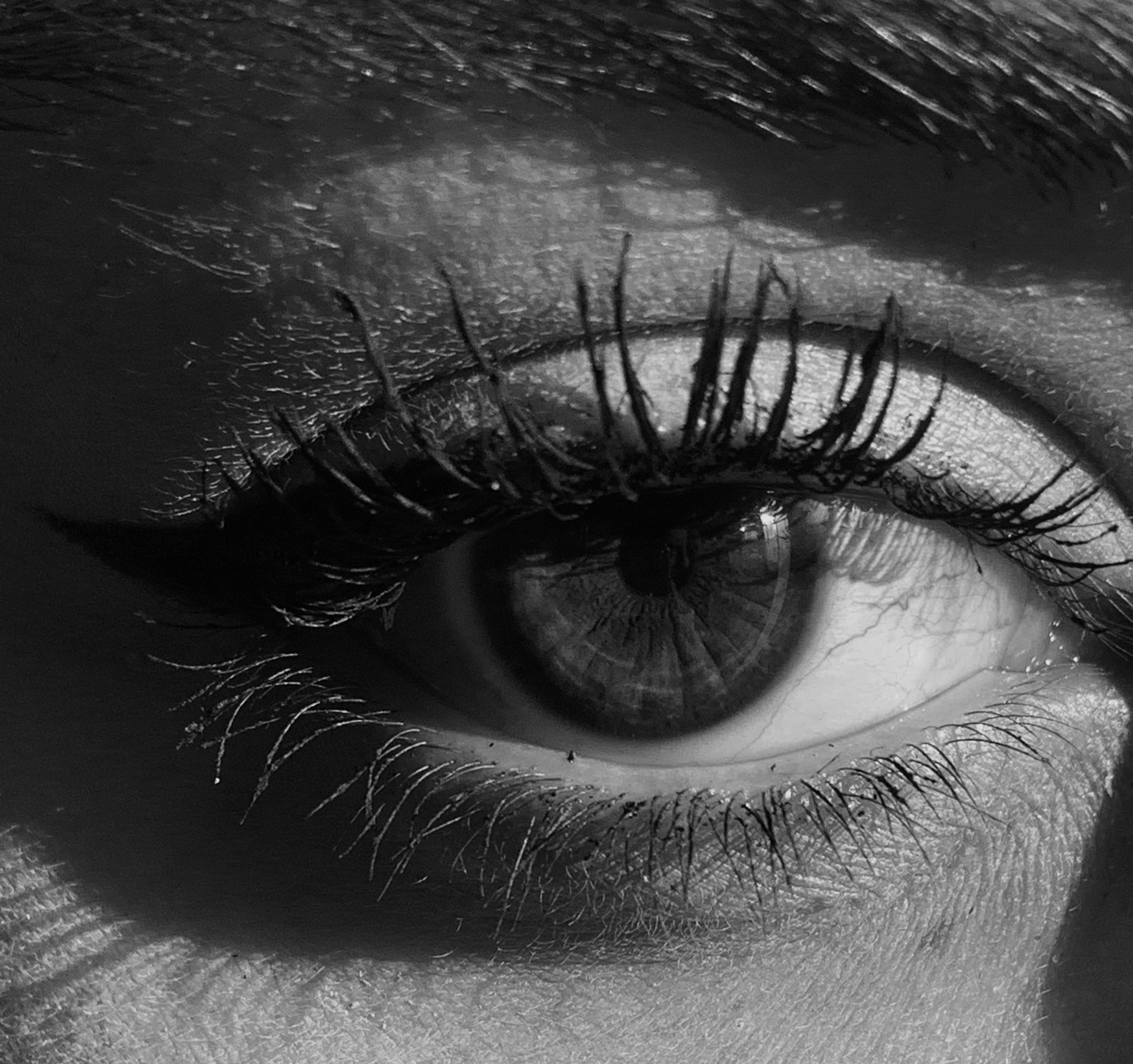 Cornea Guttata Photos, Download The BEST Free Cornea Guttata Stock ...