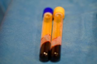 Dog Blood Types: Understanding Canine Blood Transfusions