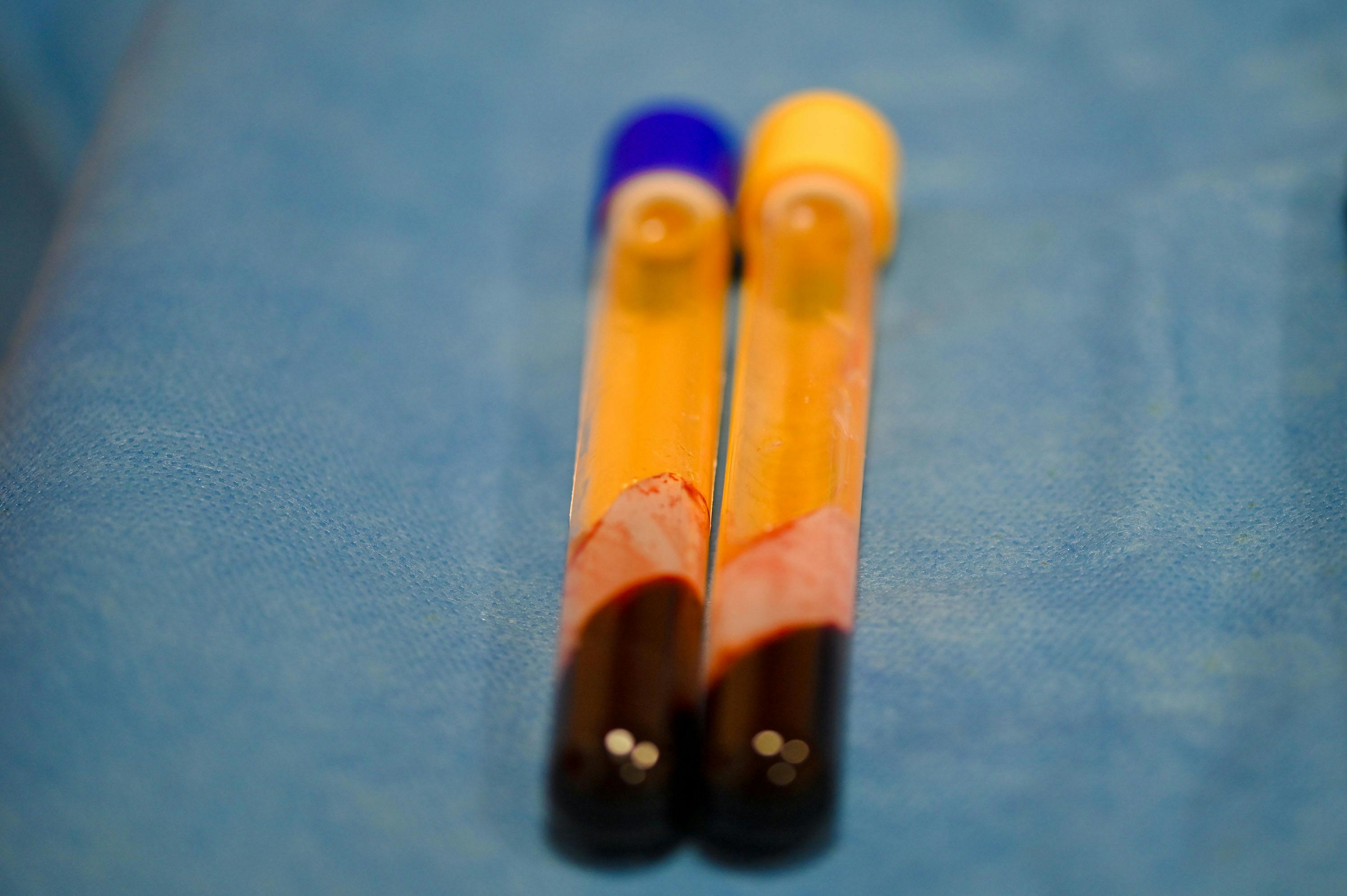 Blood Samples In Vials · Free Stock Photo