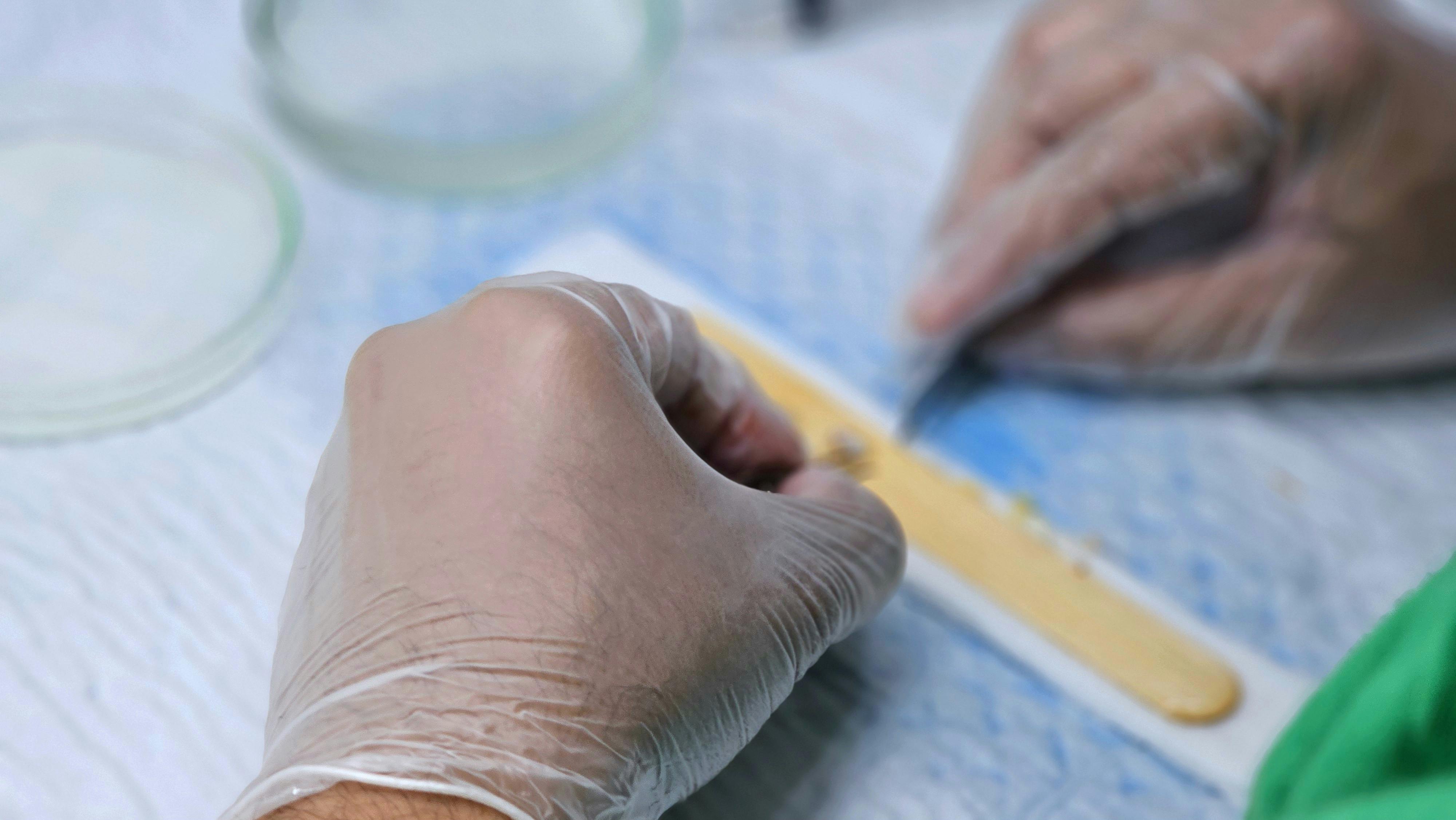 Close-up of Hands of a Doctor Wearing Gloves · Free Stock Photo