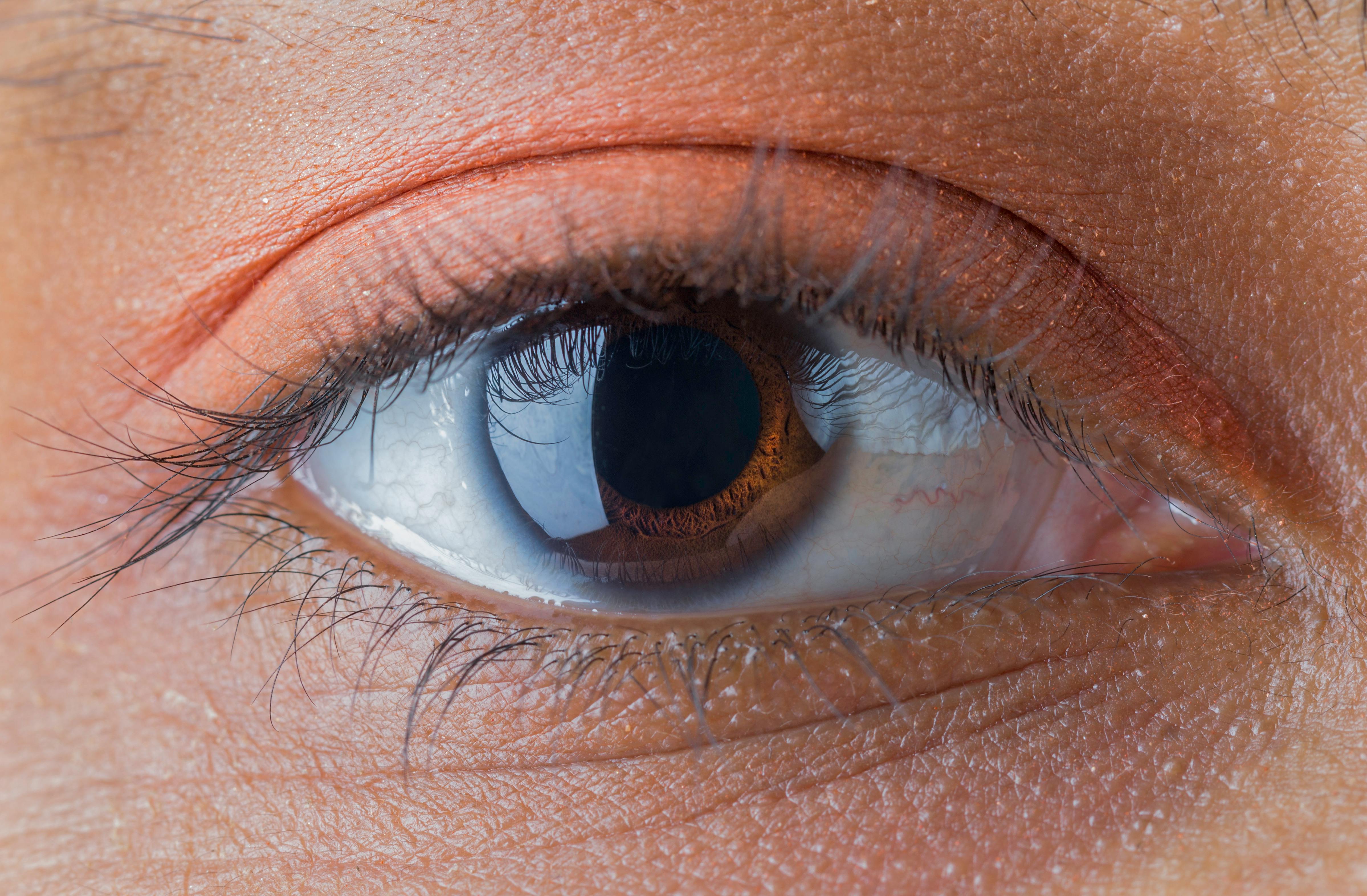 Human Eye · Free Stock Photo