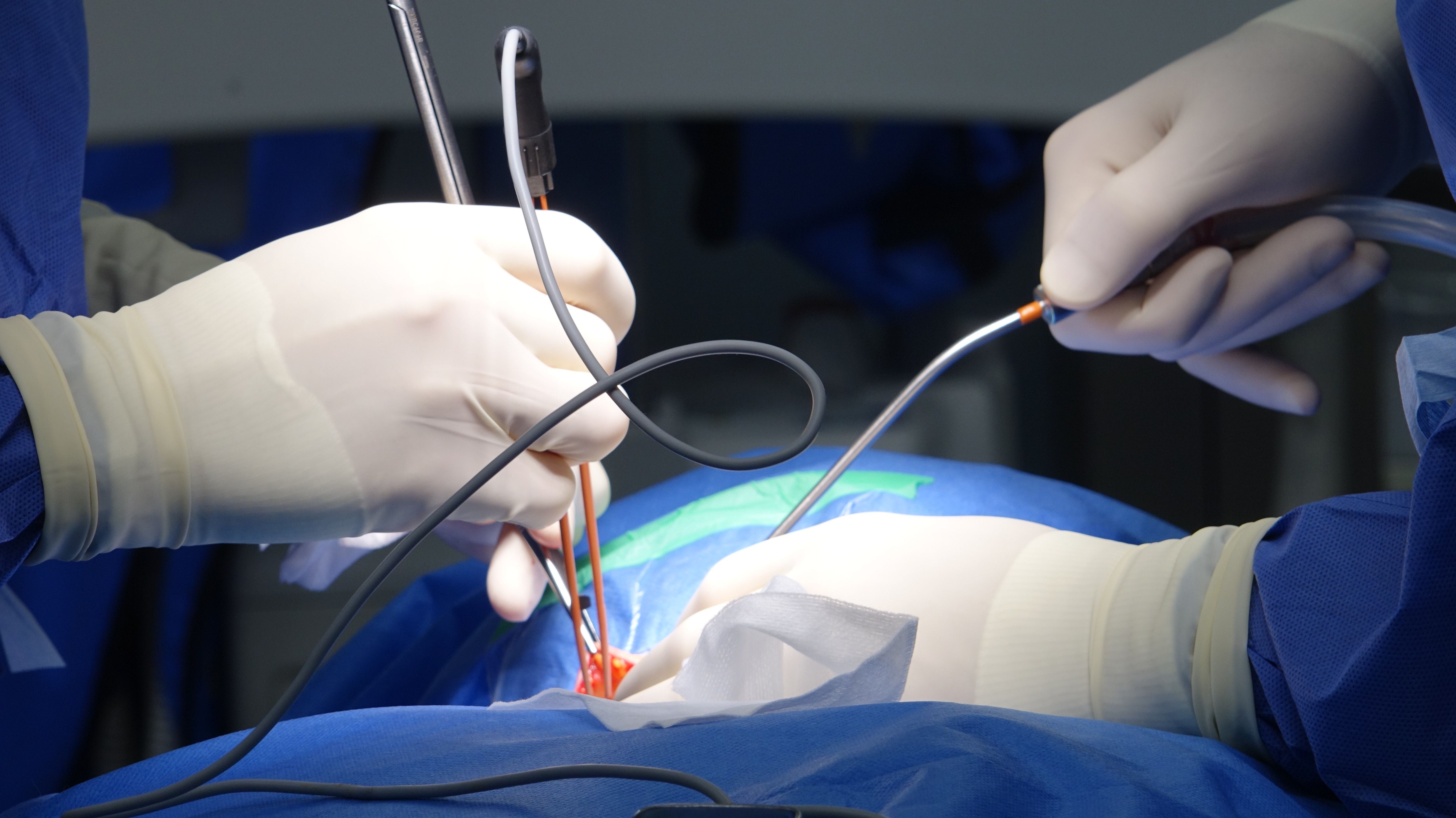 Primer Plano De Un Procedimiento Quirúrgico Con Instrumentos Médicos ...