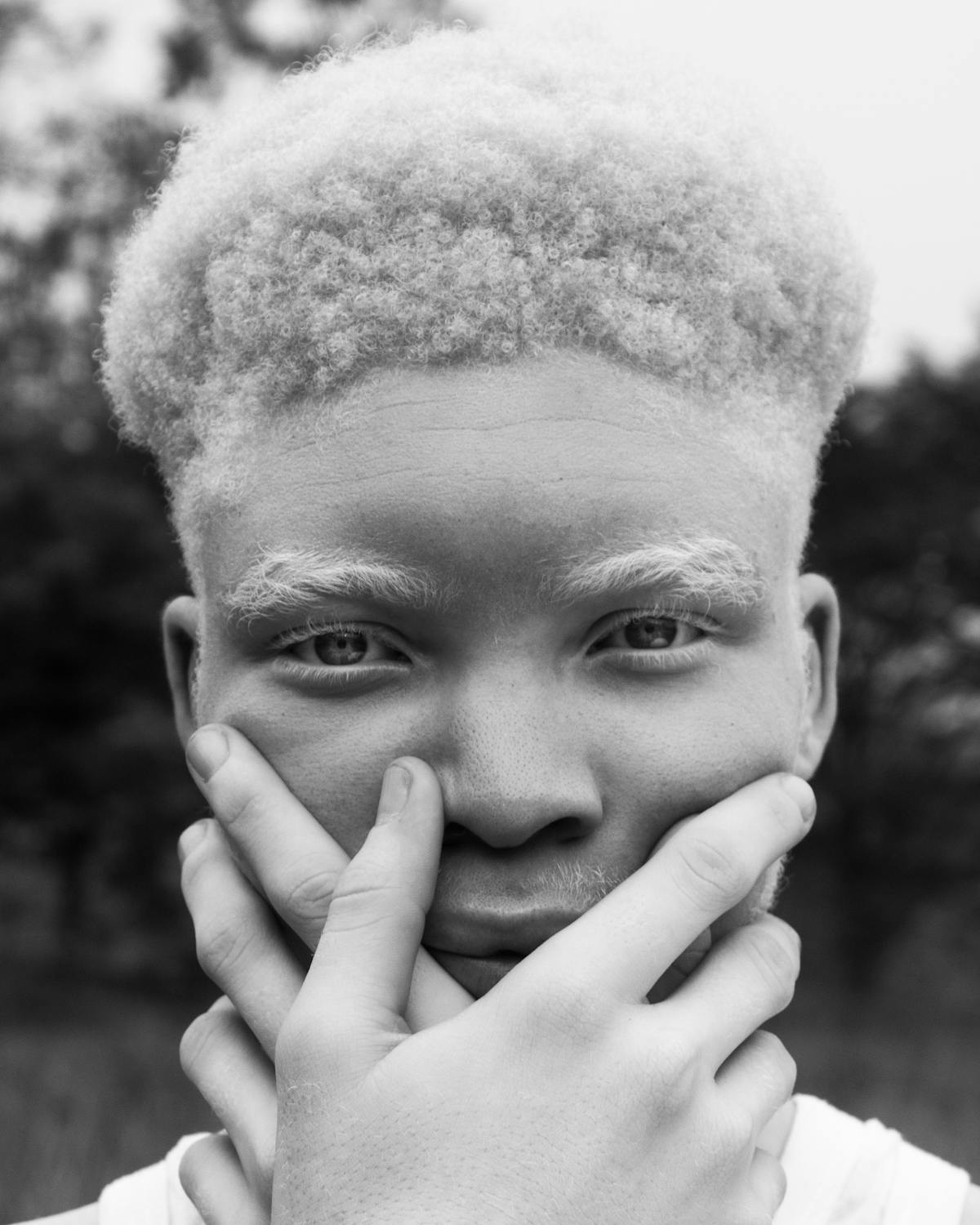 Albino Photos, Download The BEST Free Albino Stock Photos & HD Images