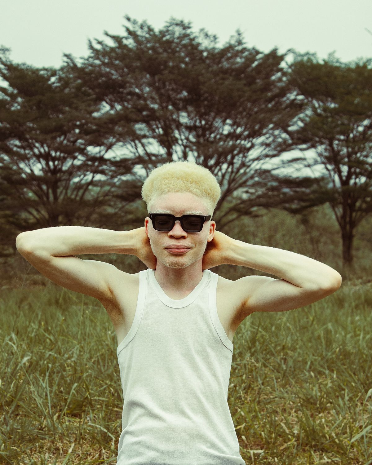 Albino Black Male Photos, Download The BEST Free Albino Black Male ...