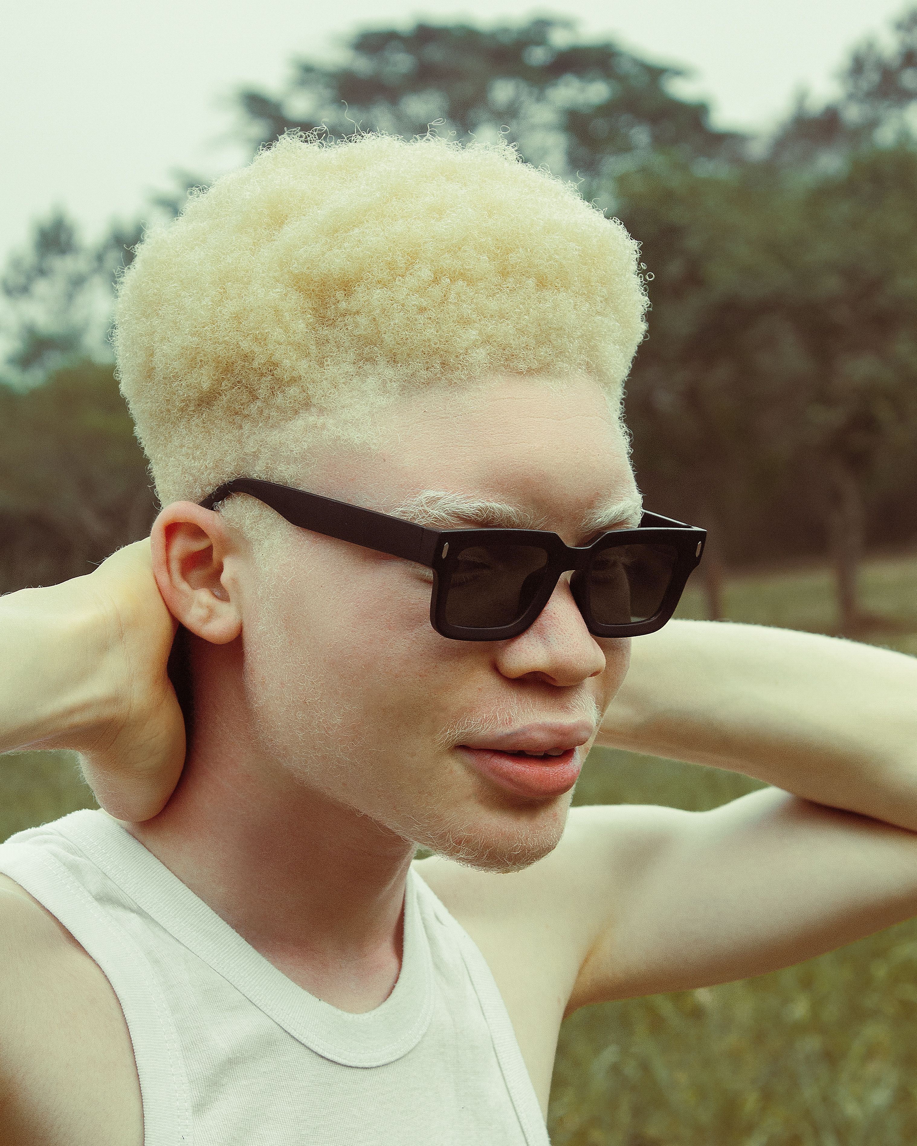 Young Man with Albino Traits Adjusts Sunglasses Outdoors · Free Stock Photo