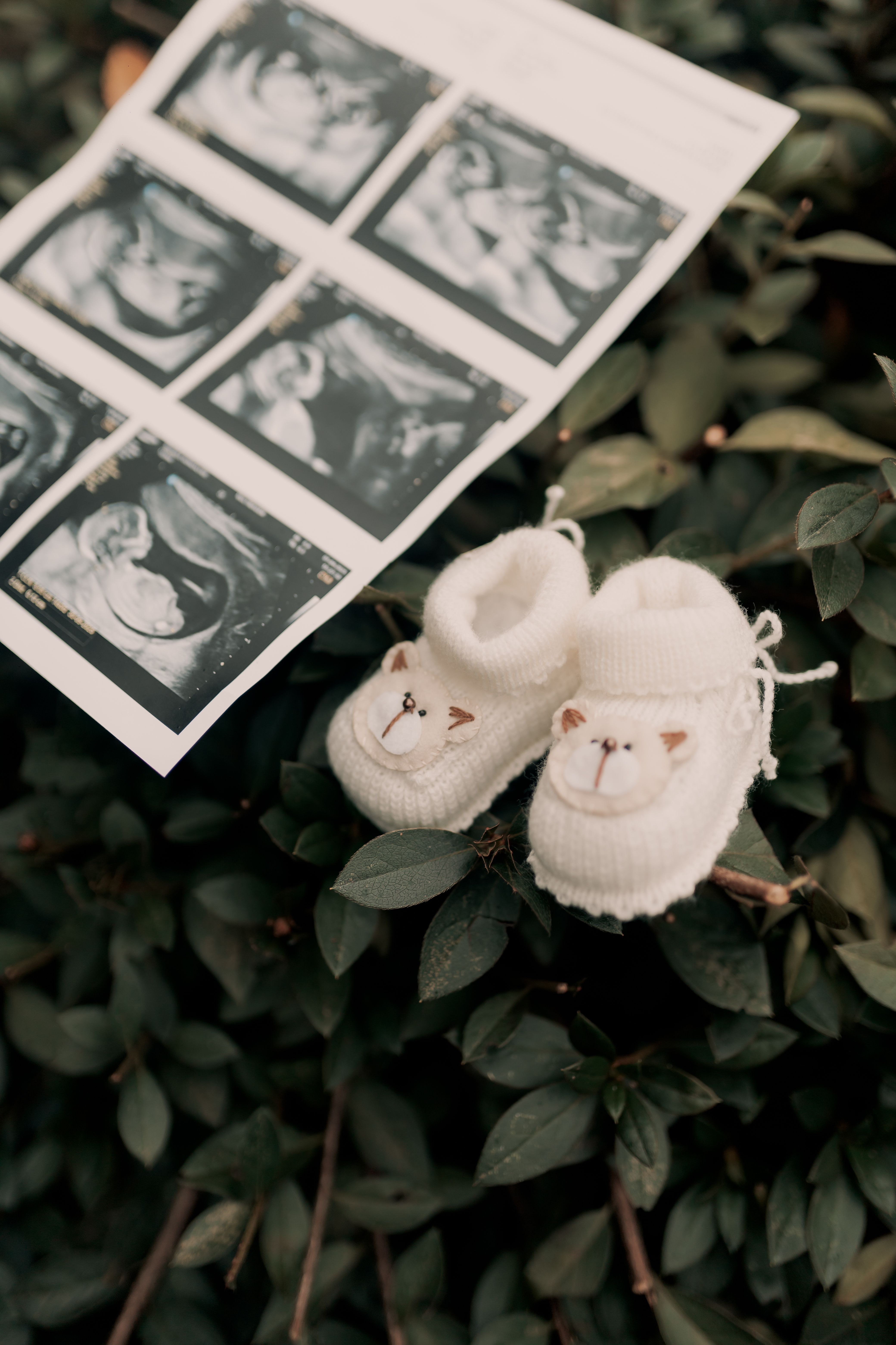 Baby Shoes with Ultrasound on Leafy Background · Free Stock Photo
