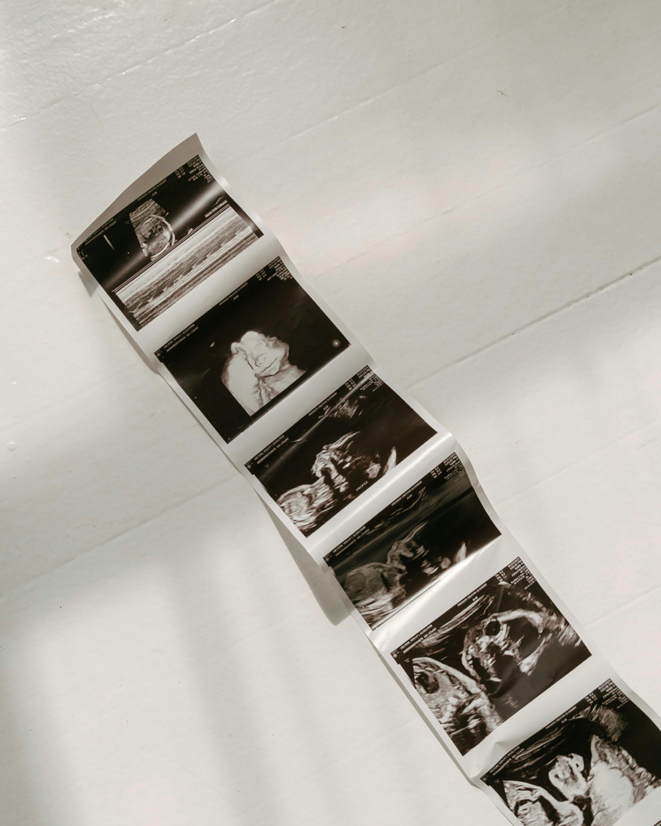 Ultrasound Film Strip on Neutral Background · Free Stock Photo