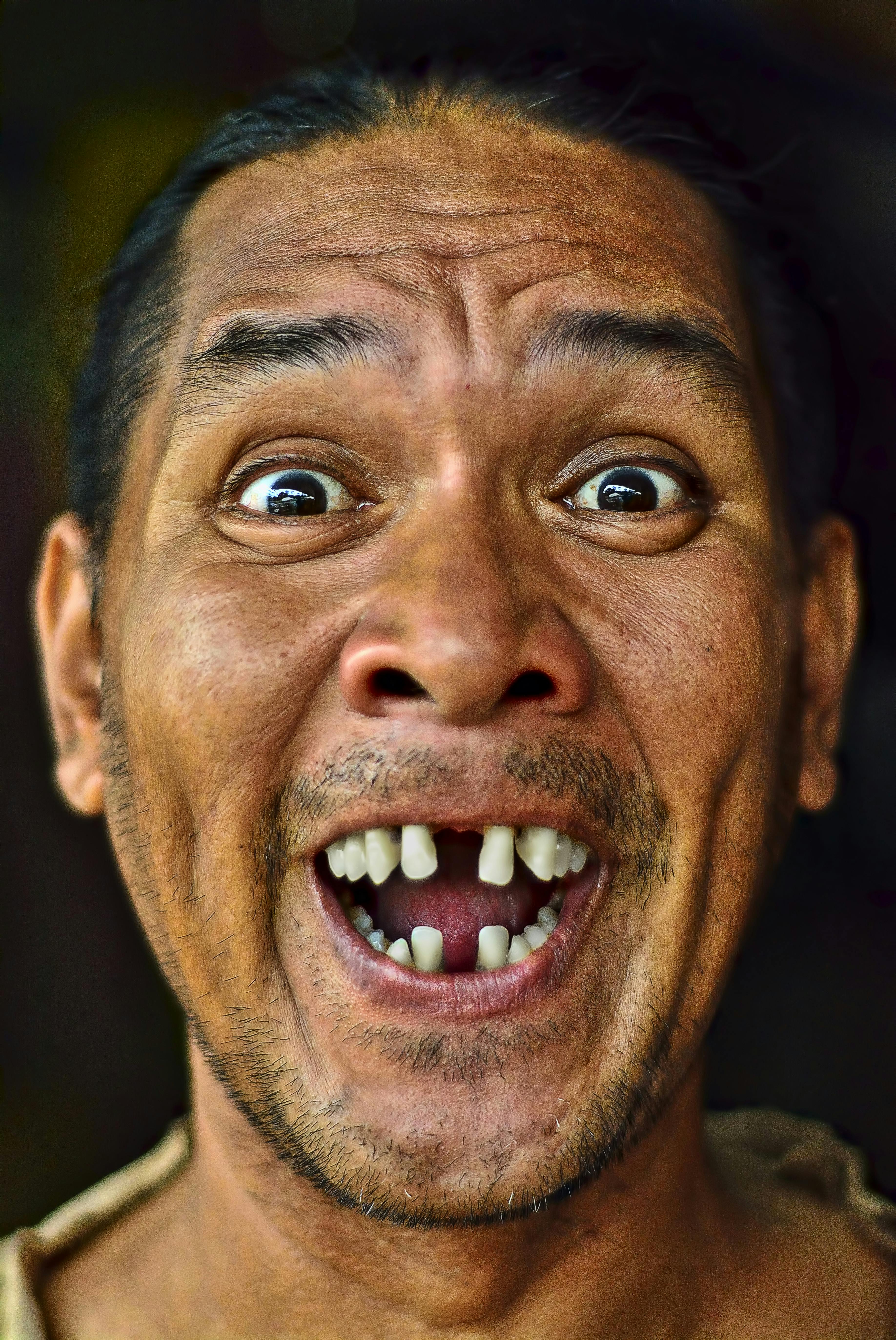 Cheerful Man with a Silly Toothless Grin · Free Stock Photo