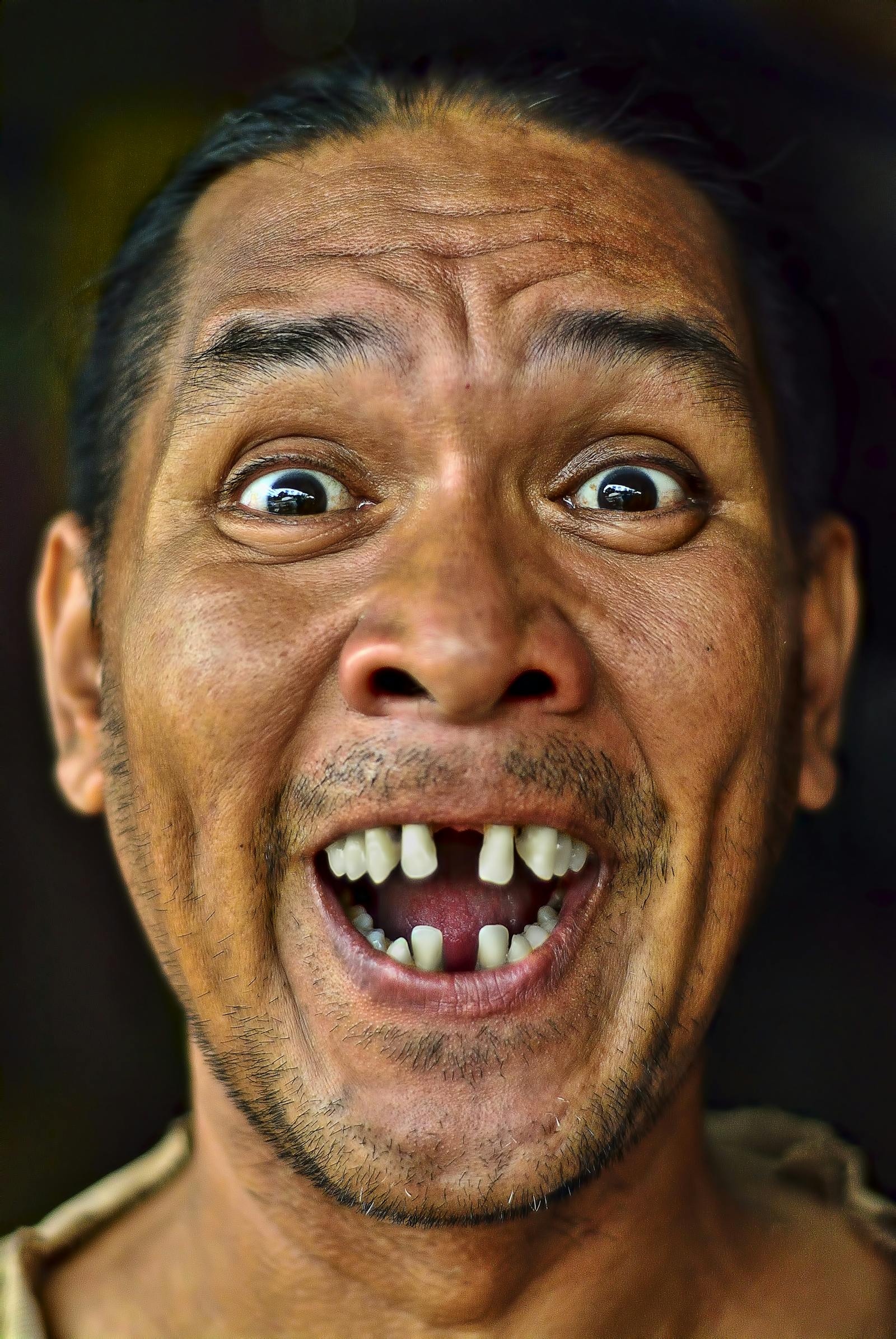 Toothless Photos, Download The BEST Free Toothless Stock Photos & HD Images