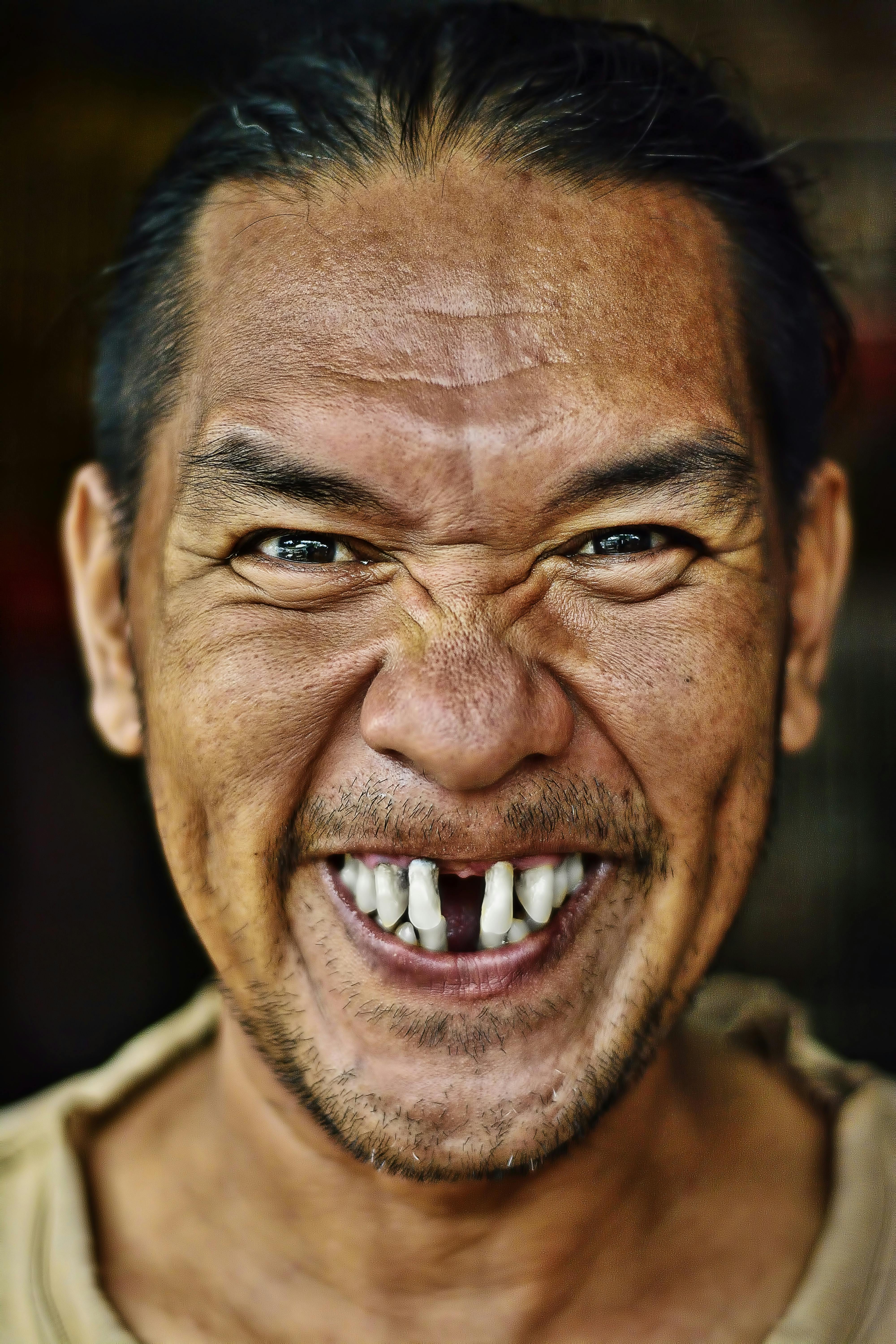 Cheerful Man with Missing Tooth Smiling Widely · Free Stock Photo
