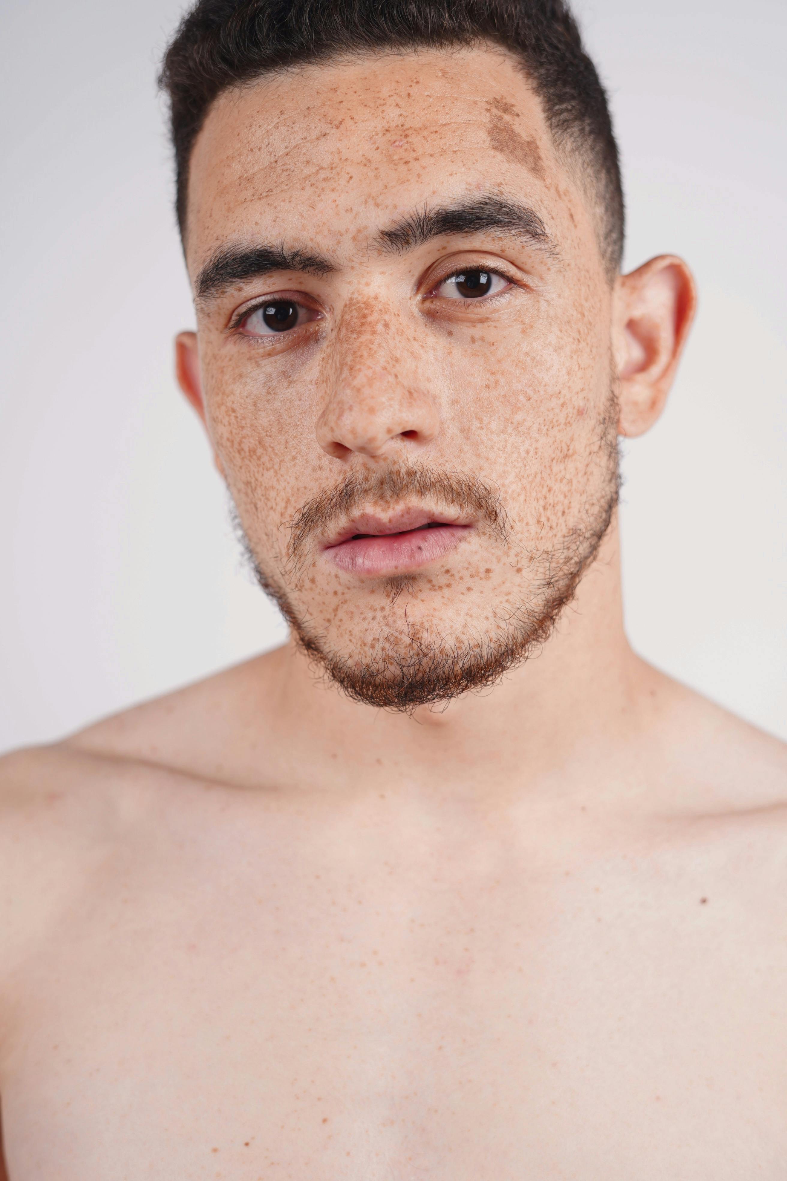 Men With Freckles Photos, Download The BEST Free Men With Freckles ...