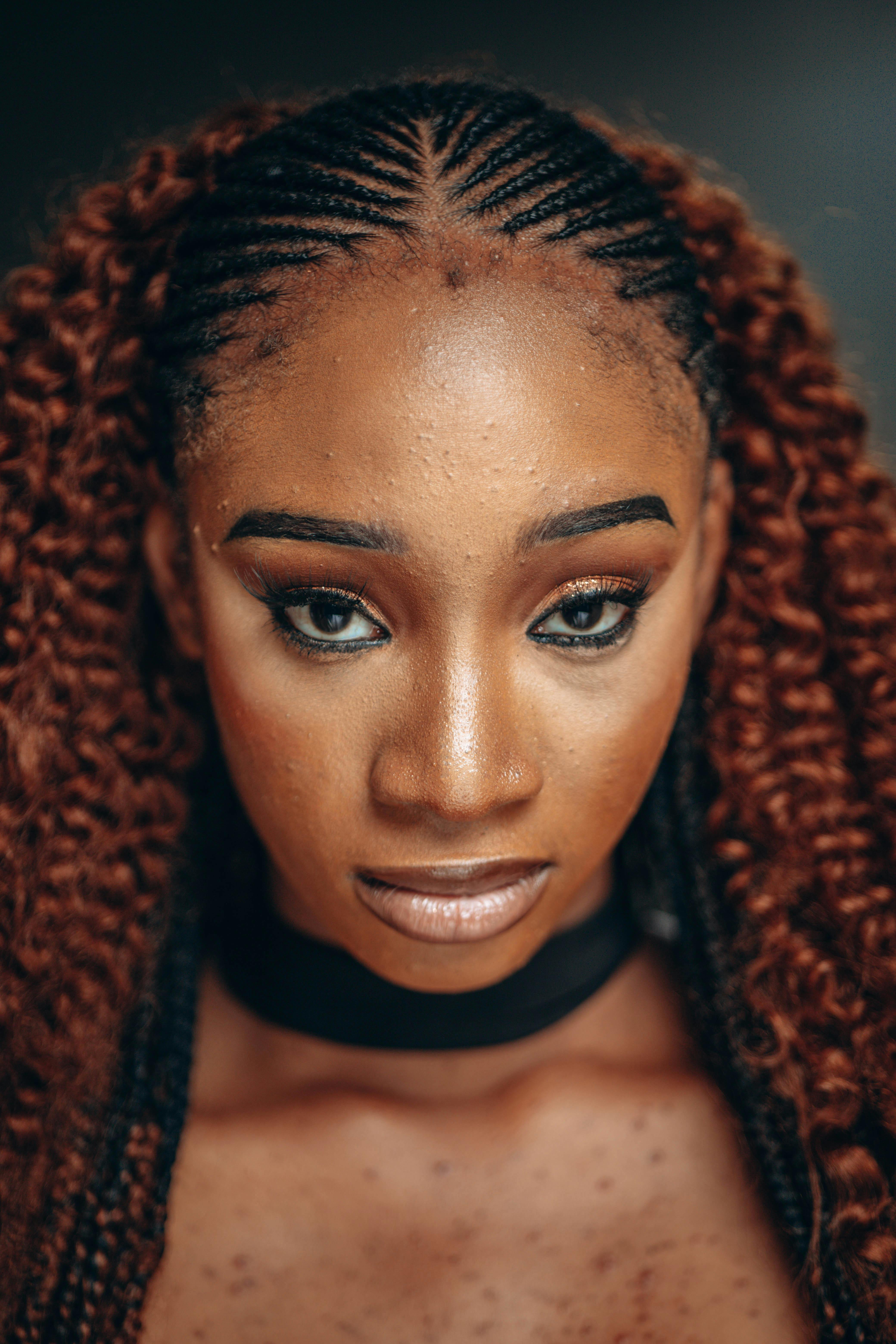 Black Spots Face Model Photos, Download The BEST Free Black Spots Face ...