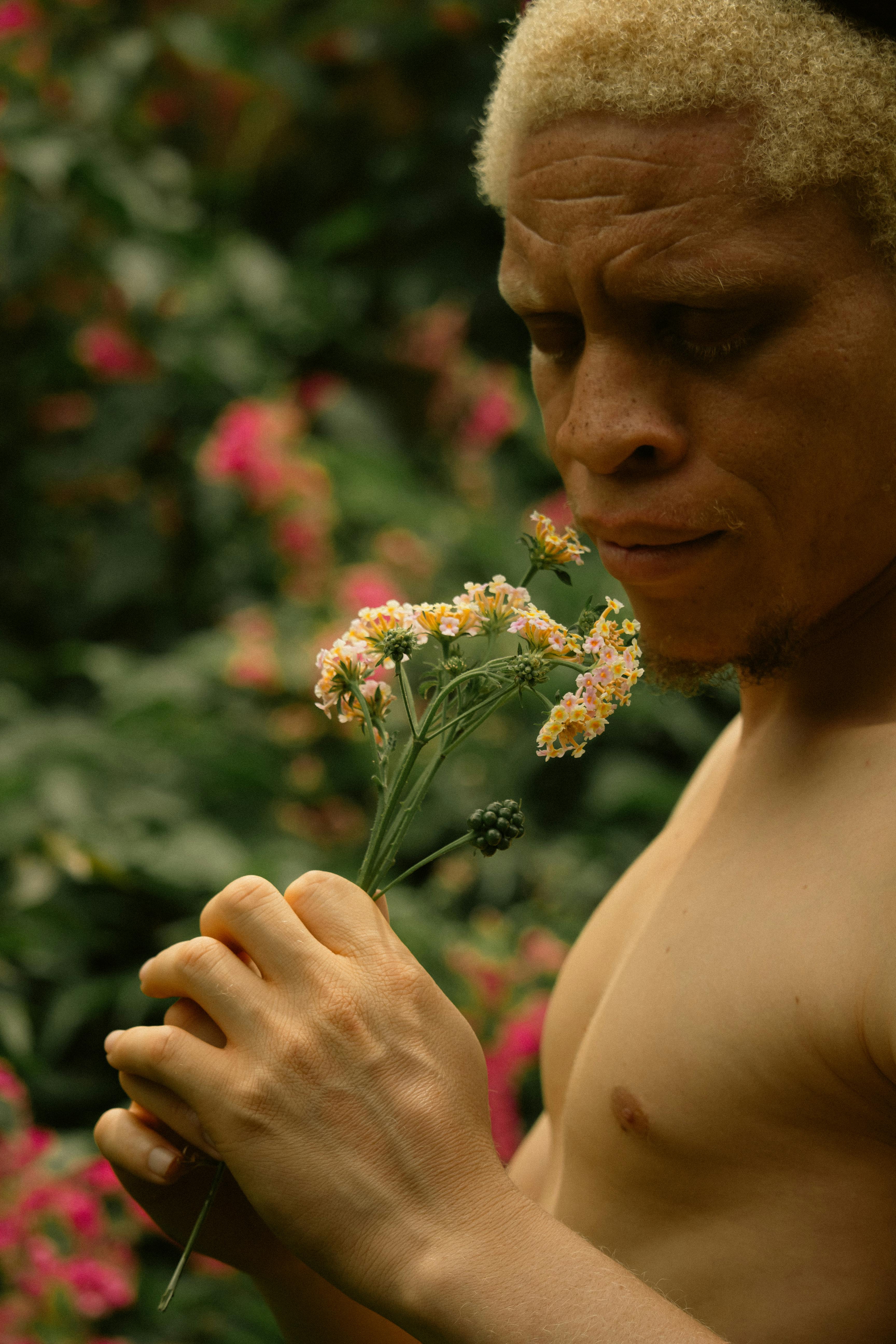 Man with Albinism Holding Flowers Outdoors · Free Stock Photo