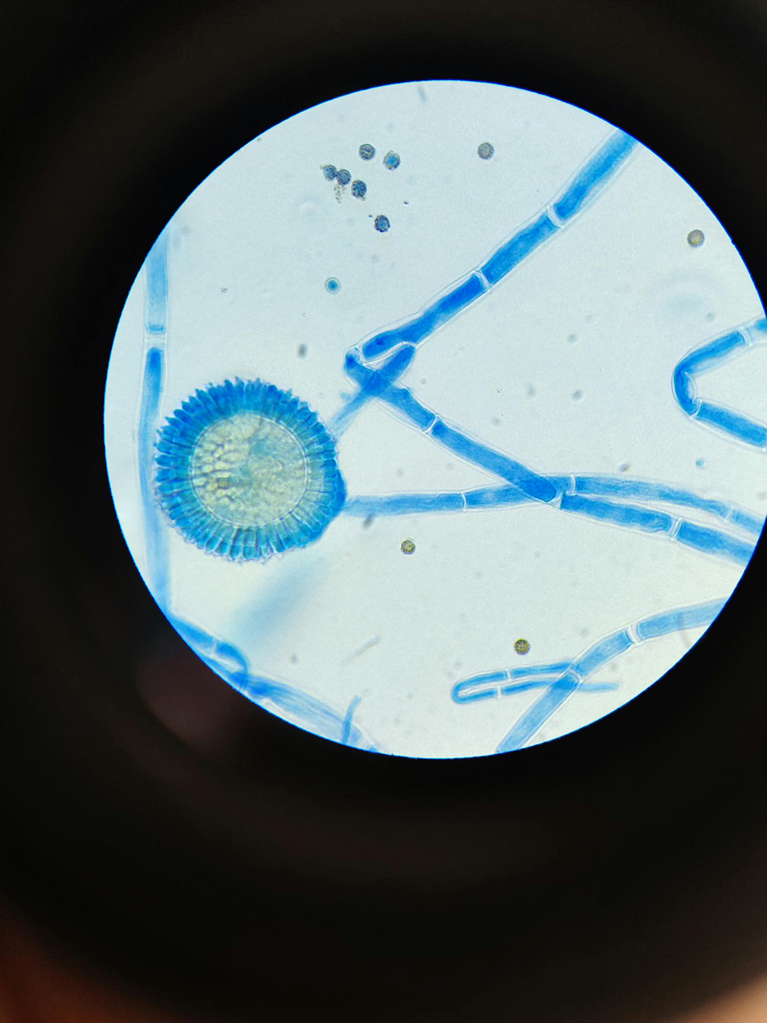Mold Spores Microscope Photos, Download The BEST Free Mold Spores ...