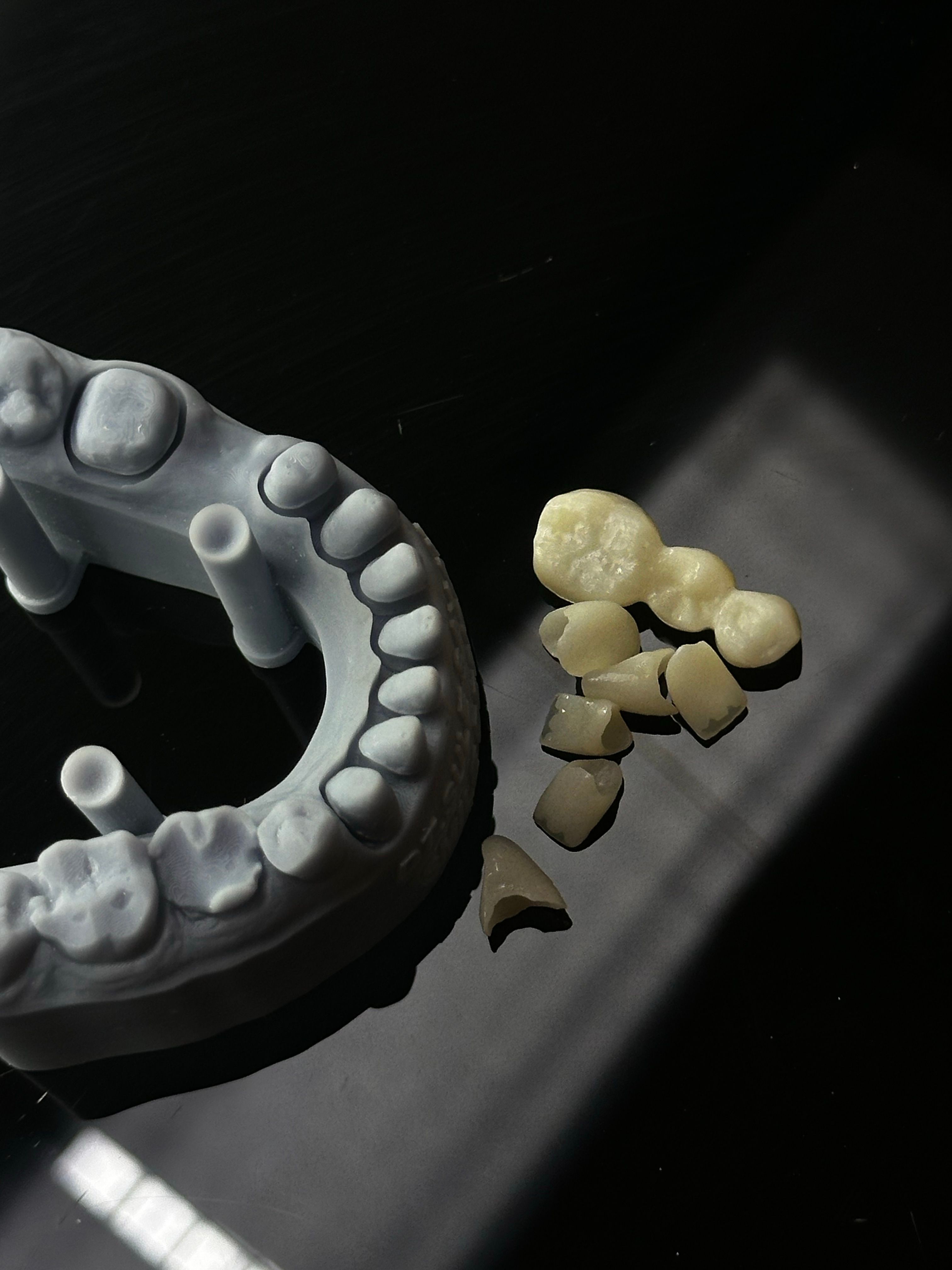 Dental Mold with Artificial Teeth on Black Surface · Free Stock Photo